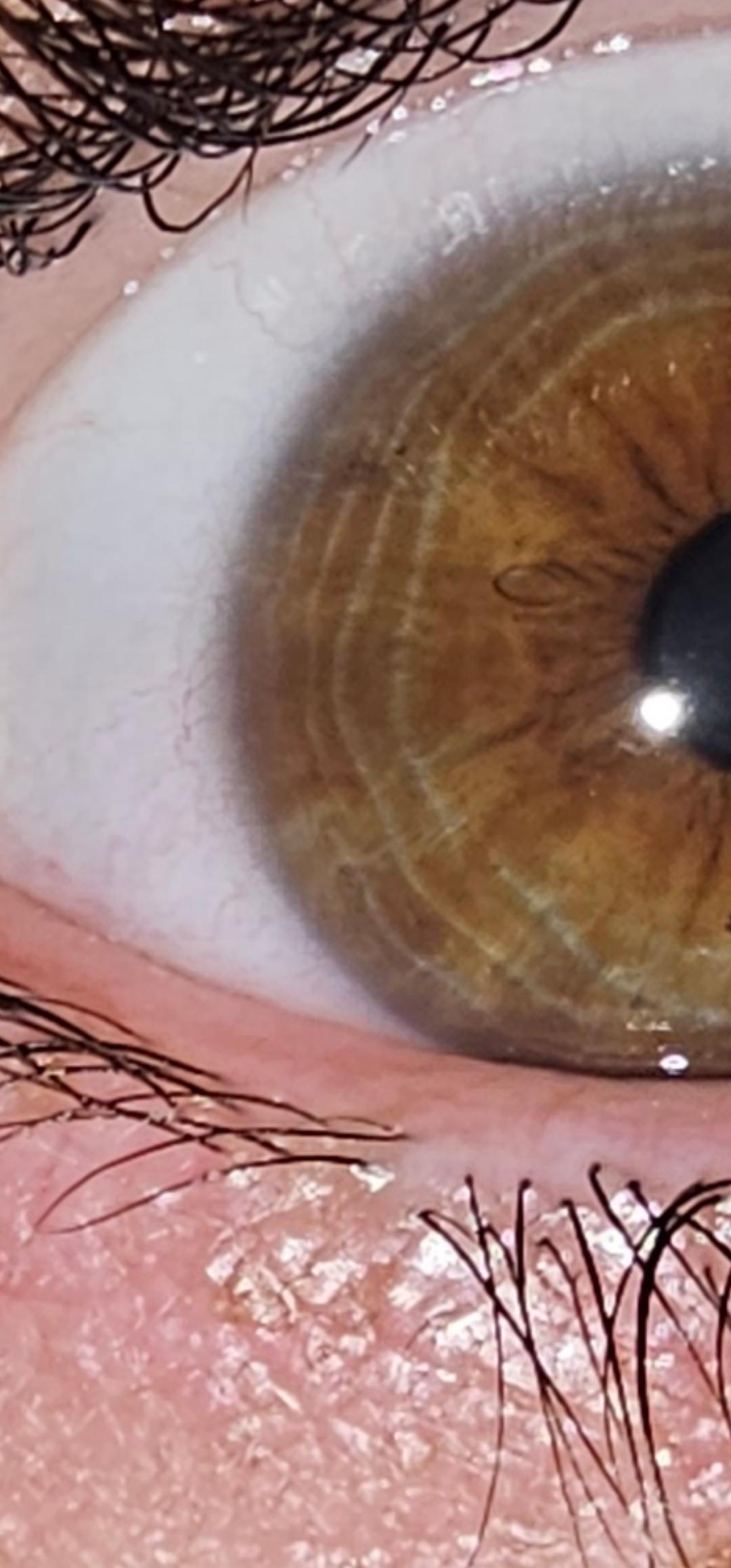 These rings in my iris | Scrolller