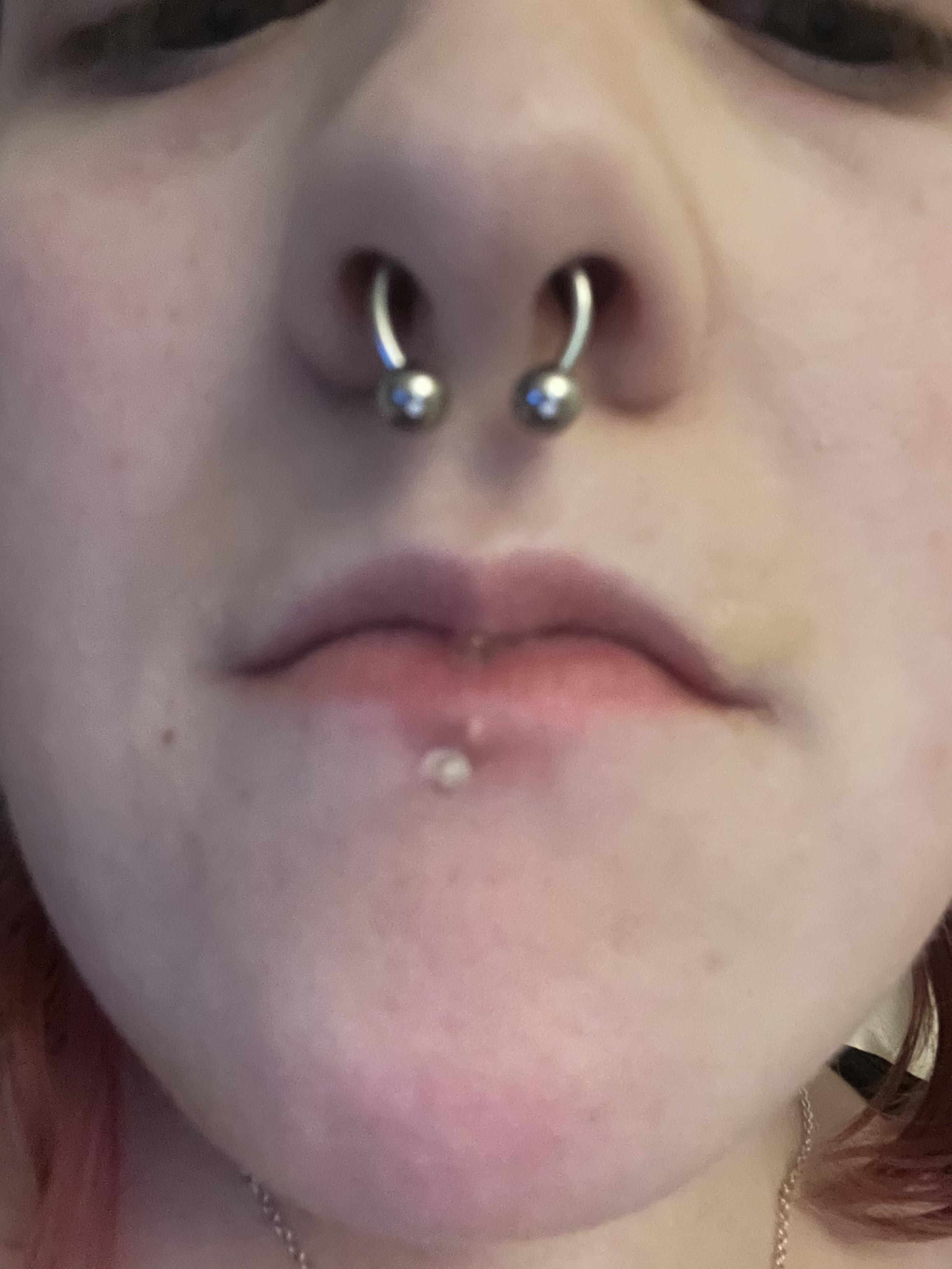 Bump on bottom of my 2 year old vertical labret piercing | Scrolller