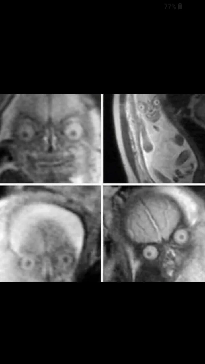 MRI scans on pregnant women | Scrolller