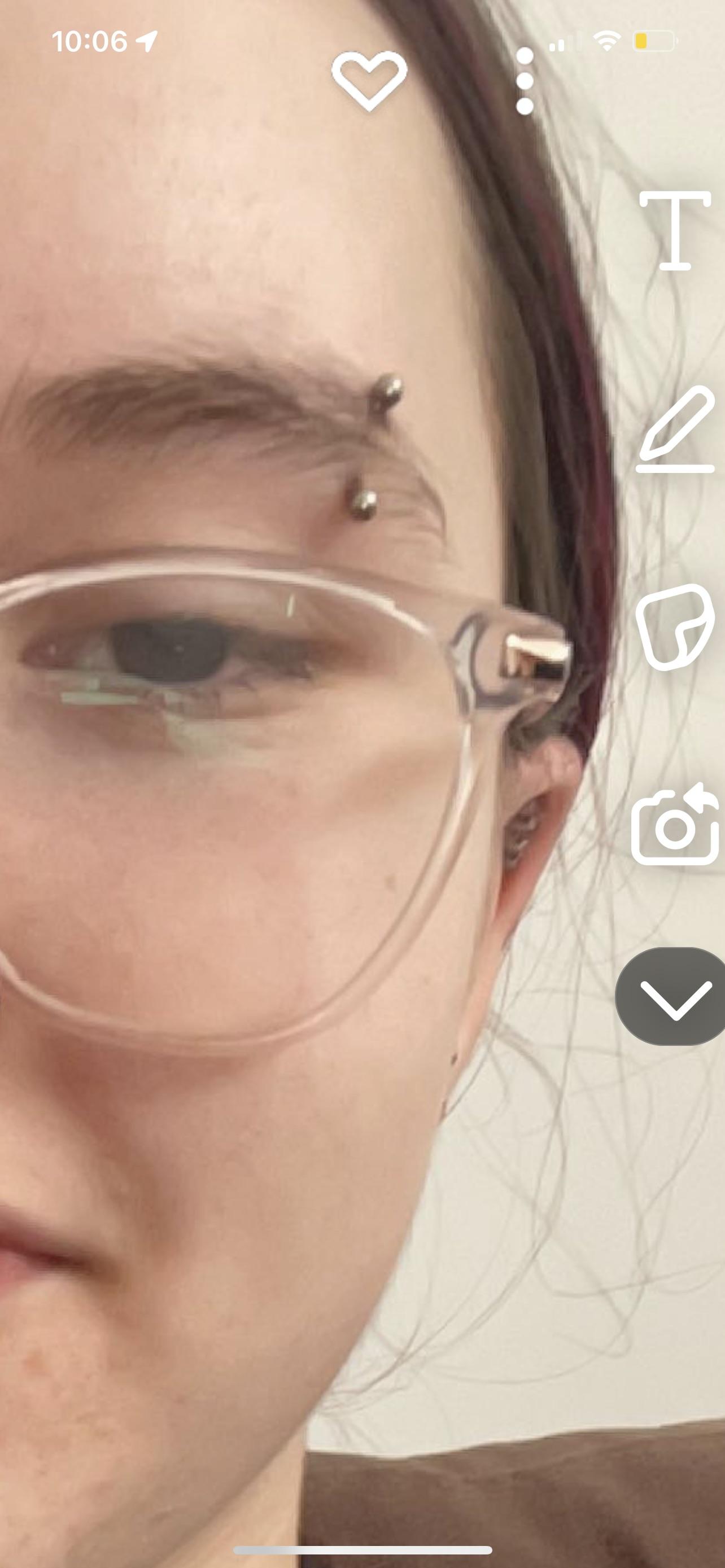 Eyebrow piercing rejection | Scrolller