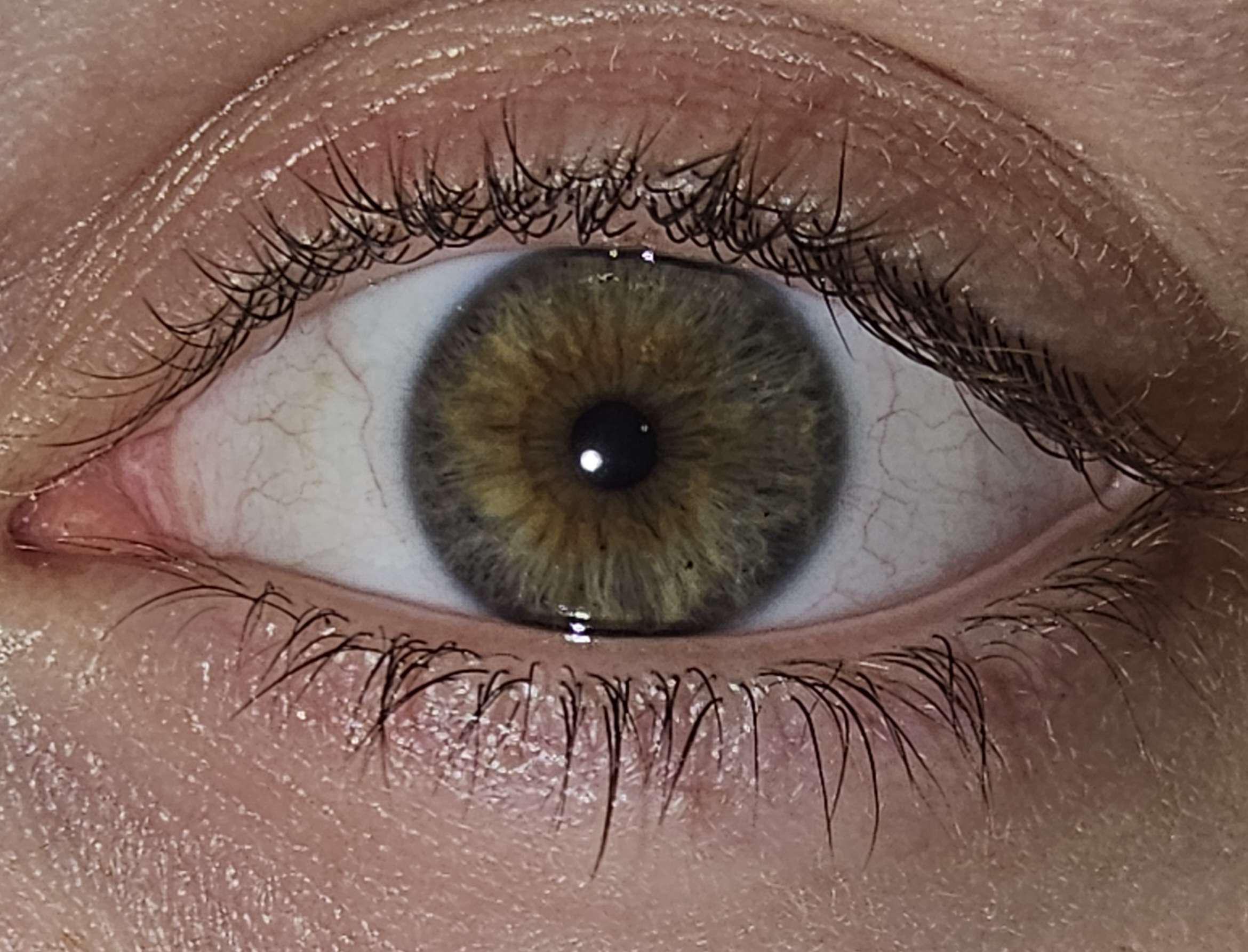 Do you think this is hazel or heterochromia? | Scrolller