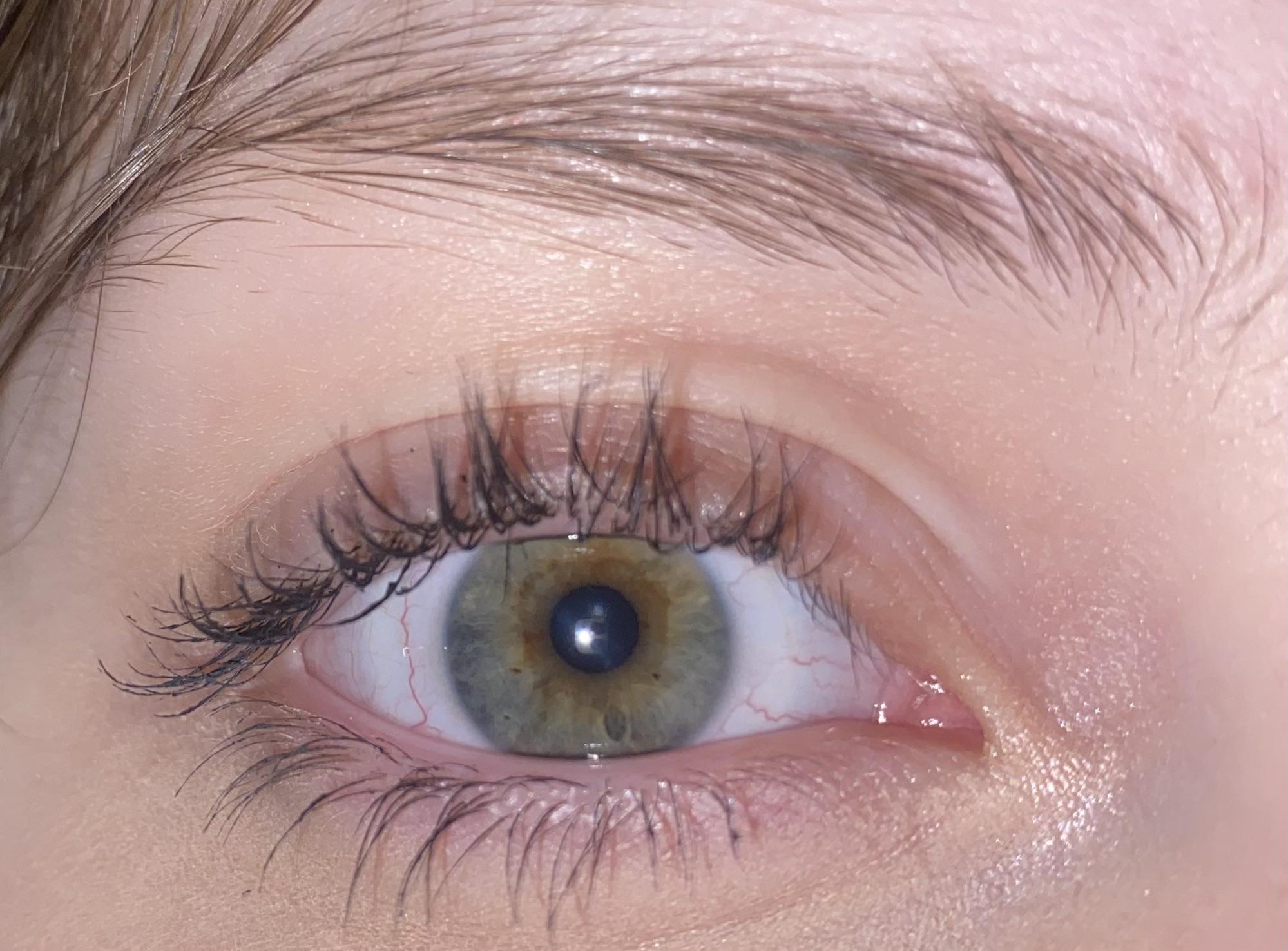 central heterochromia? green? hazel? | Scrolller