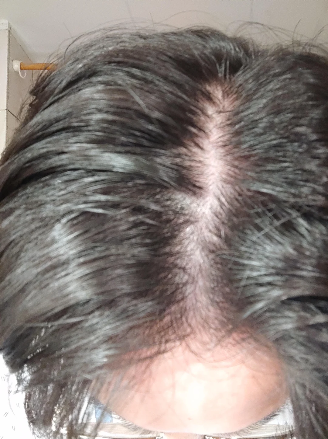 Am I balding? | Scrolller