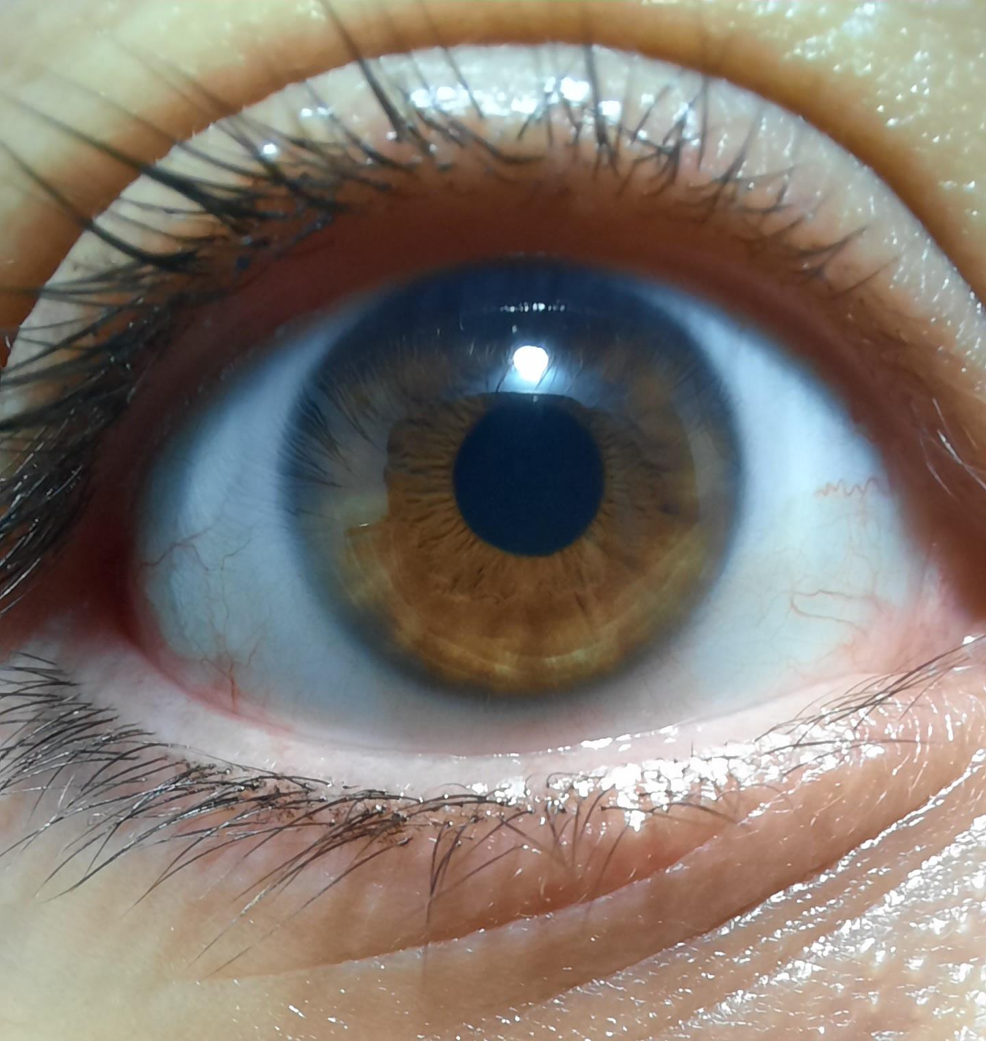 Another one asking the same | Scrolller