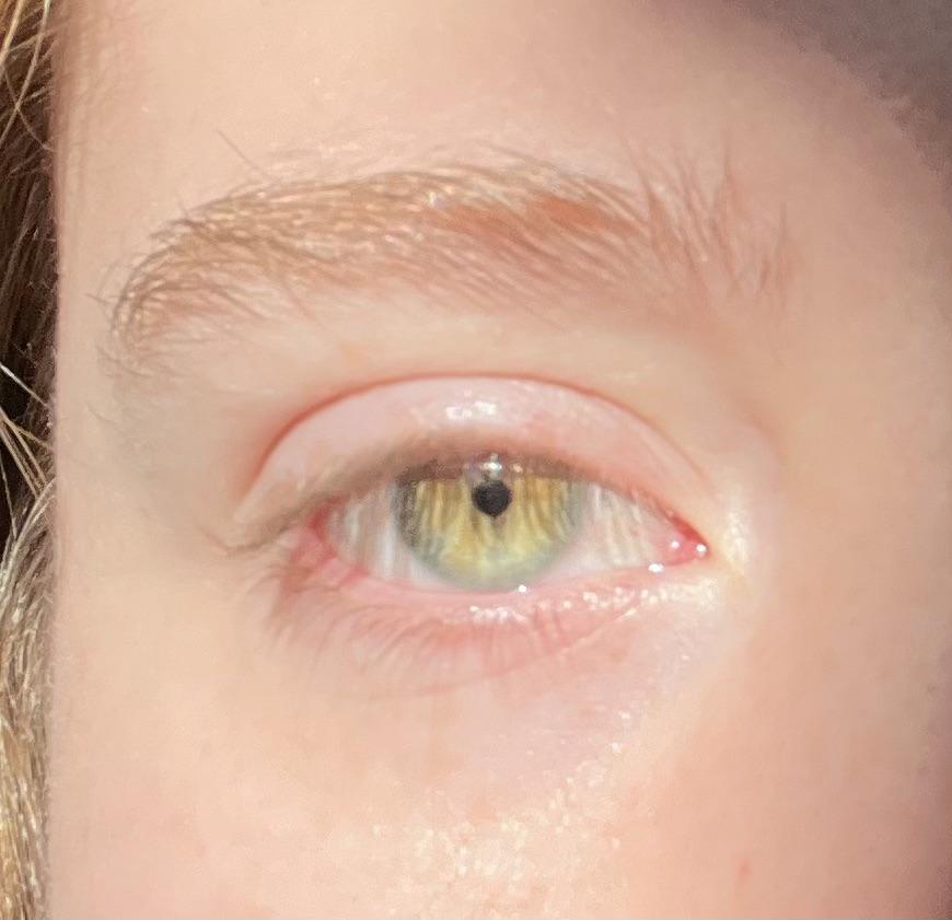 Just eye | Scrolller