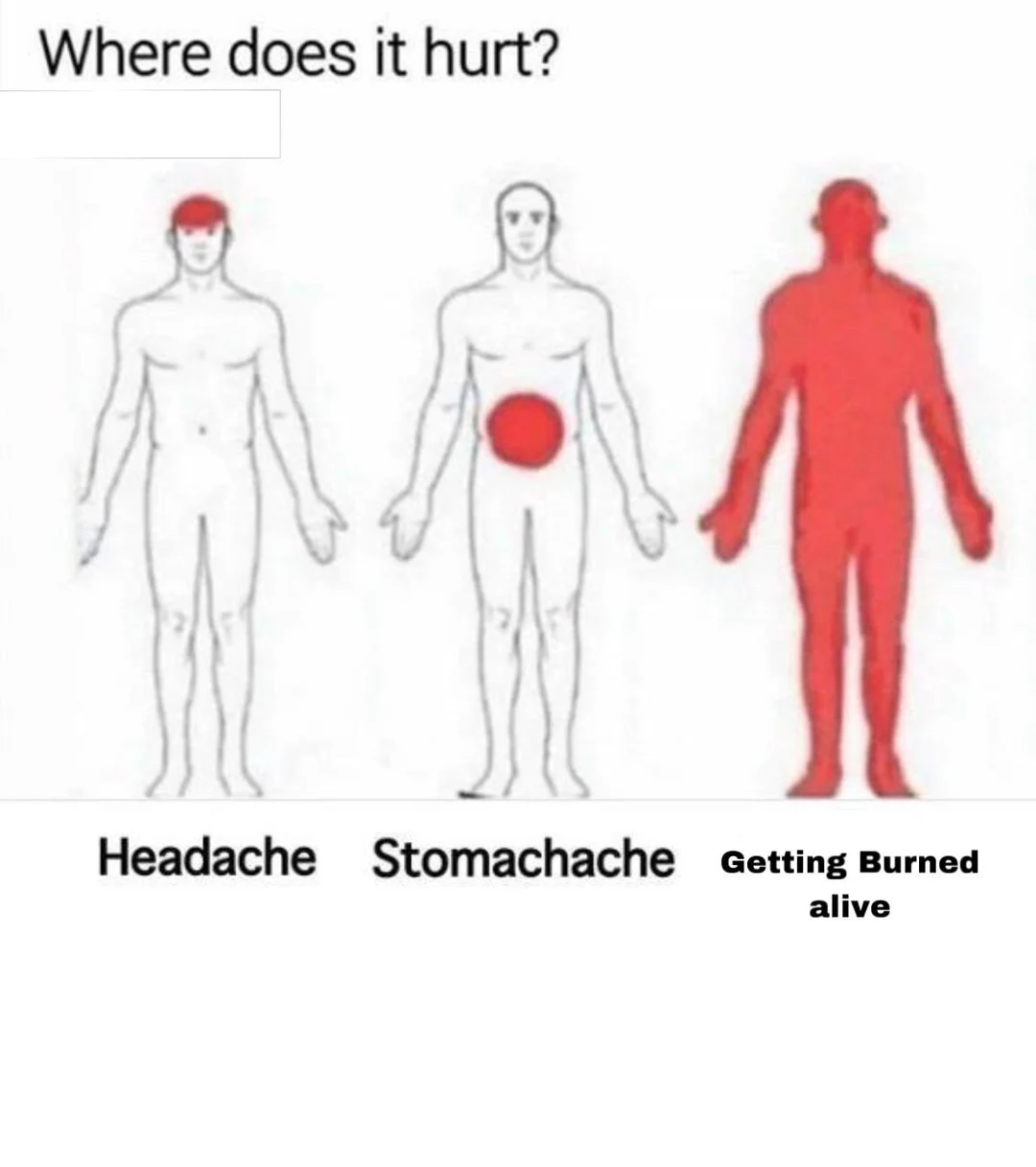 It hurts man | Scrolller