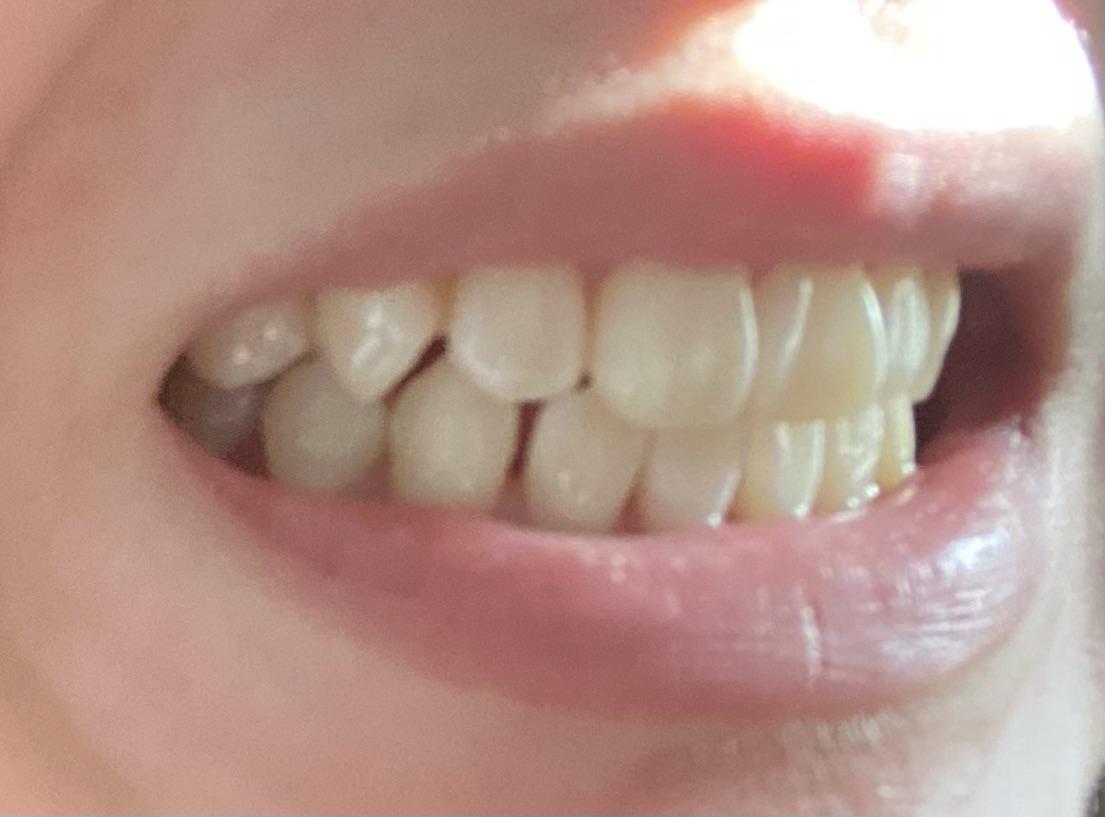 ~7 month progress | Scrolller