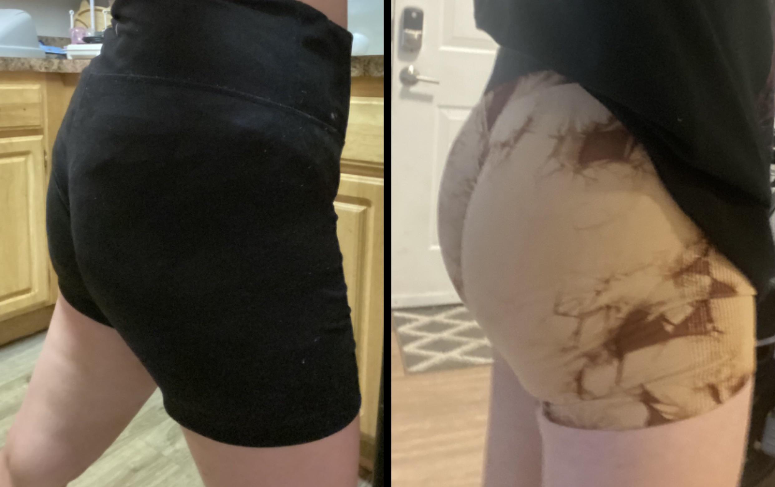 Glute progress! | Scrolller