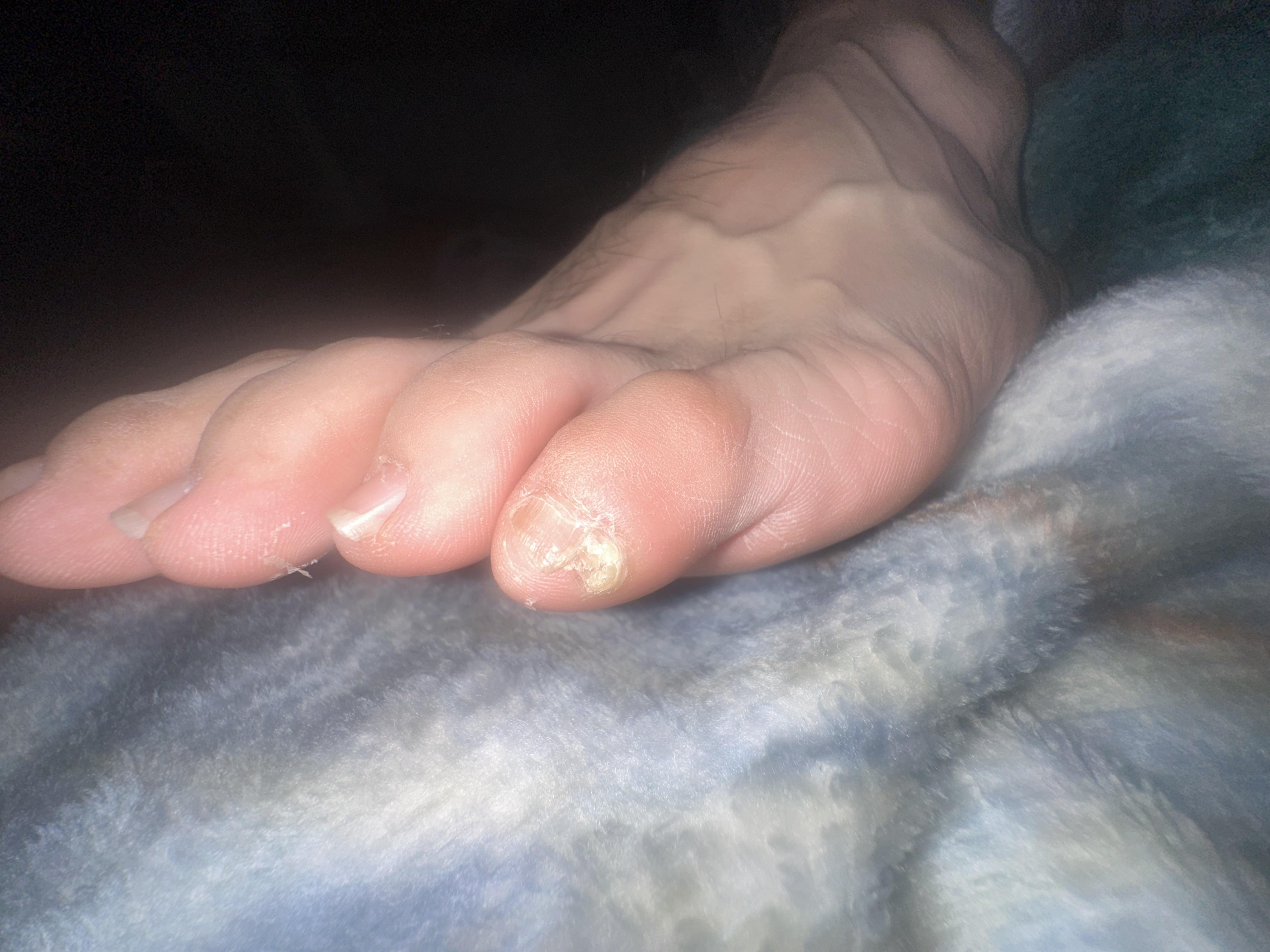 Help pls | Scrolller