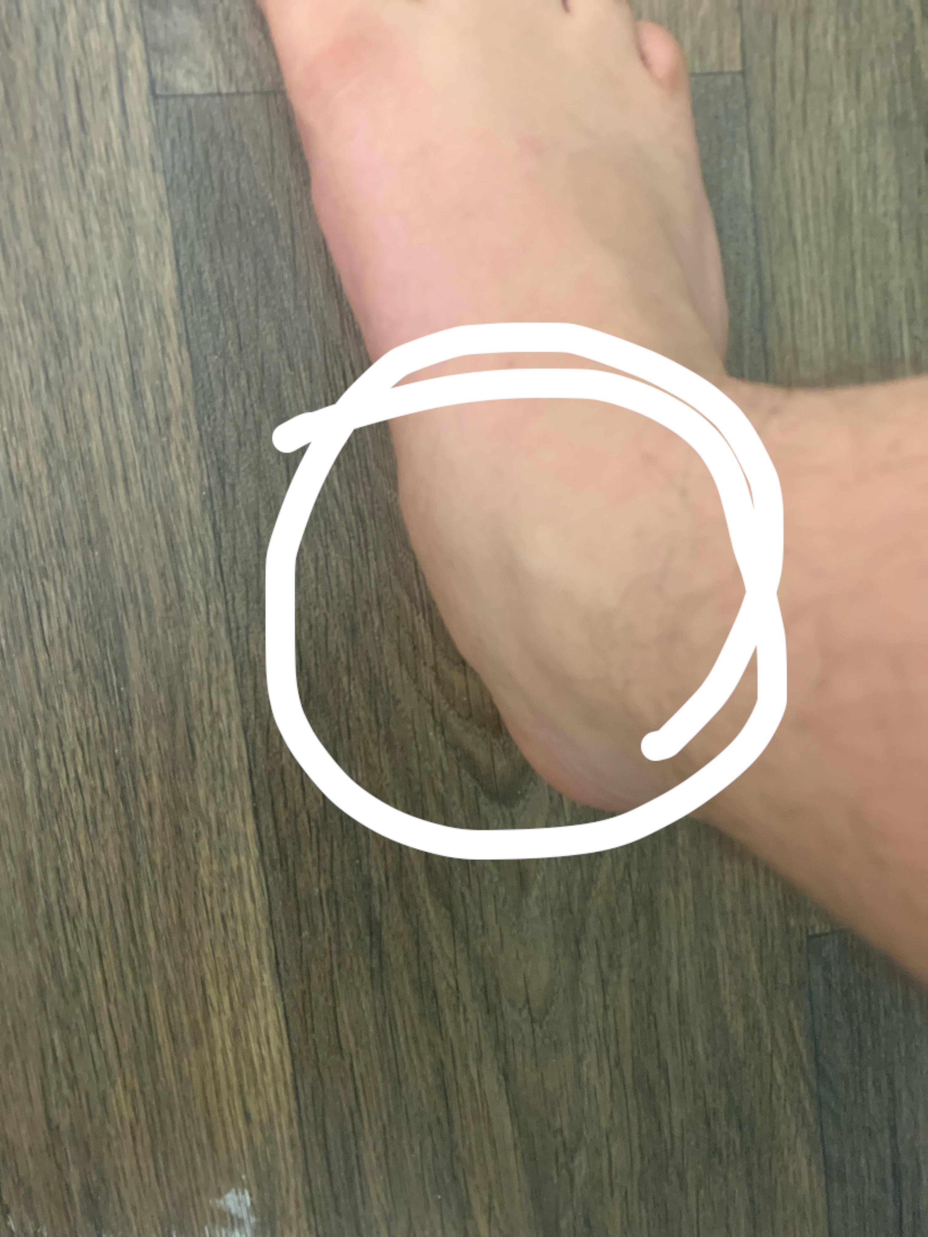 How to fix | Scrolller