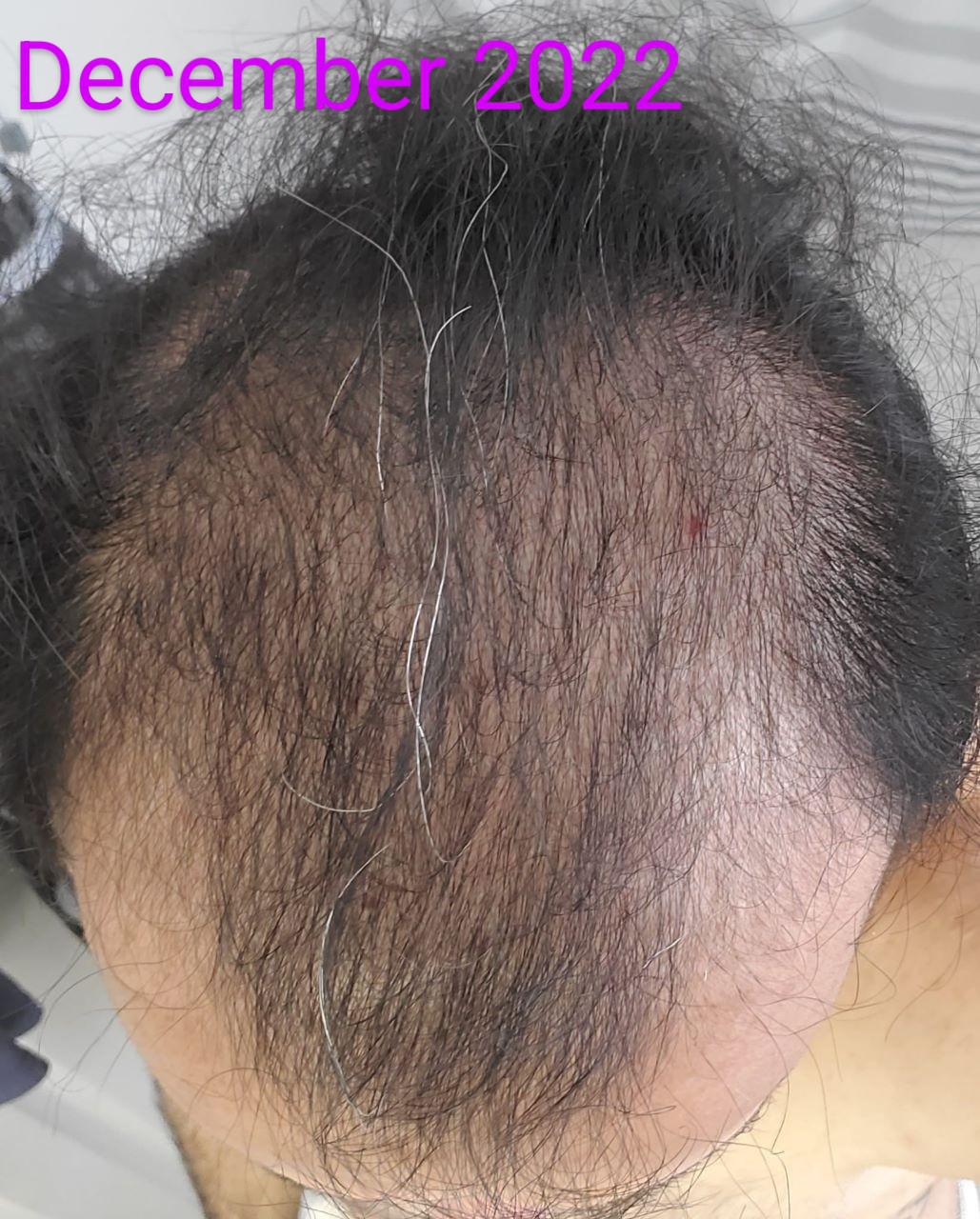 Seeing any progress? | Scrolller