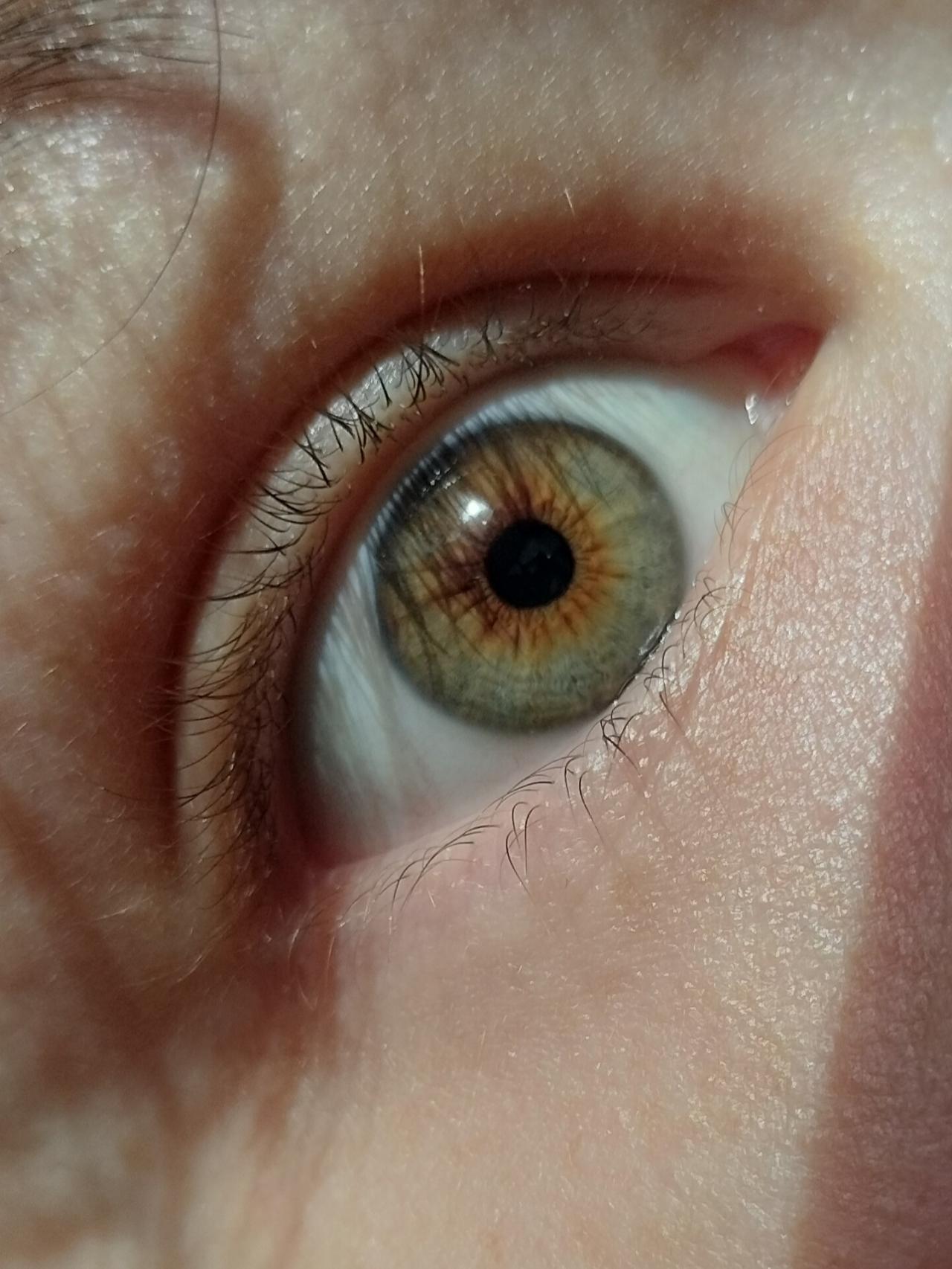 Do I have central heterochromia? Or is this just hazel? | Scrolller