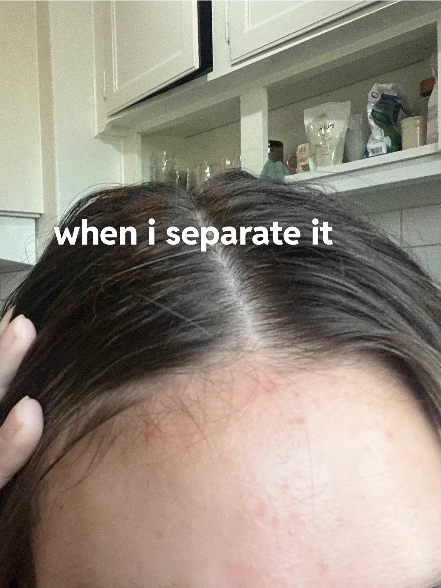 Any advice on taming a hairline cowlick? | Scrolller