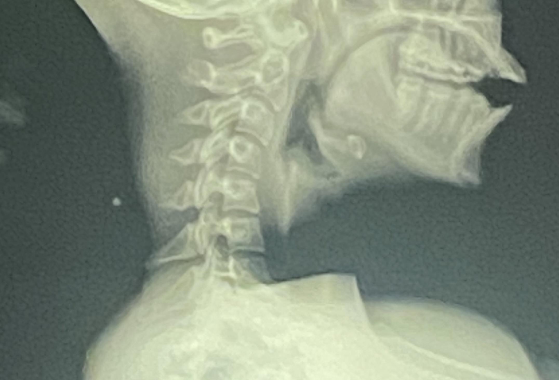 Anatomy Pictures Scrolller