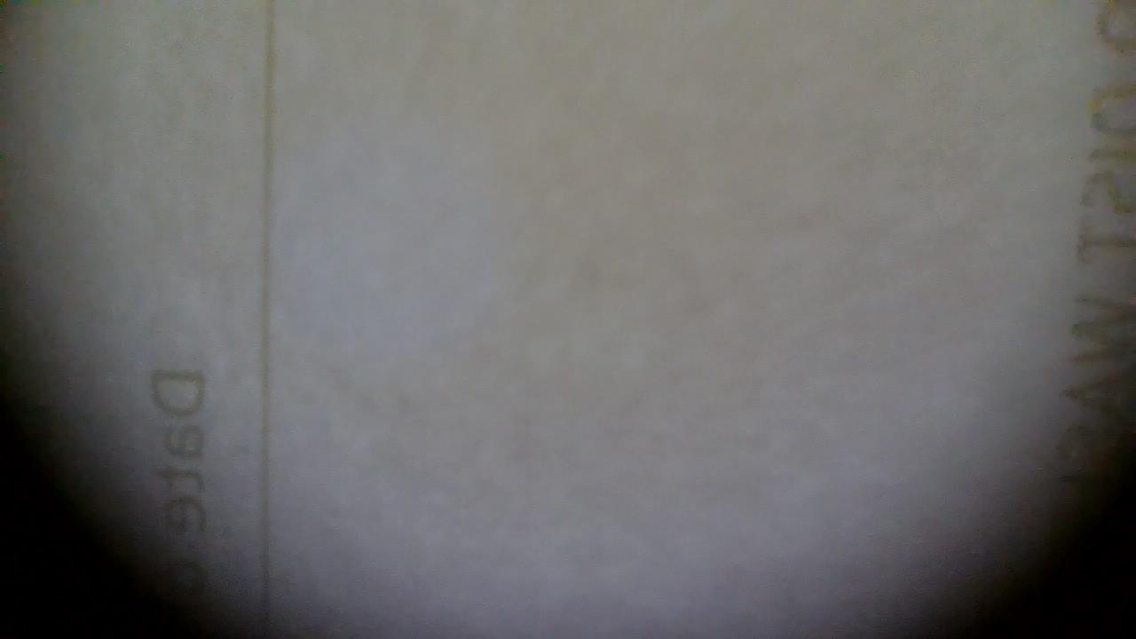 Is it normal | Scrolller