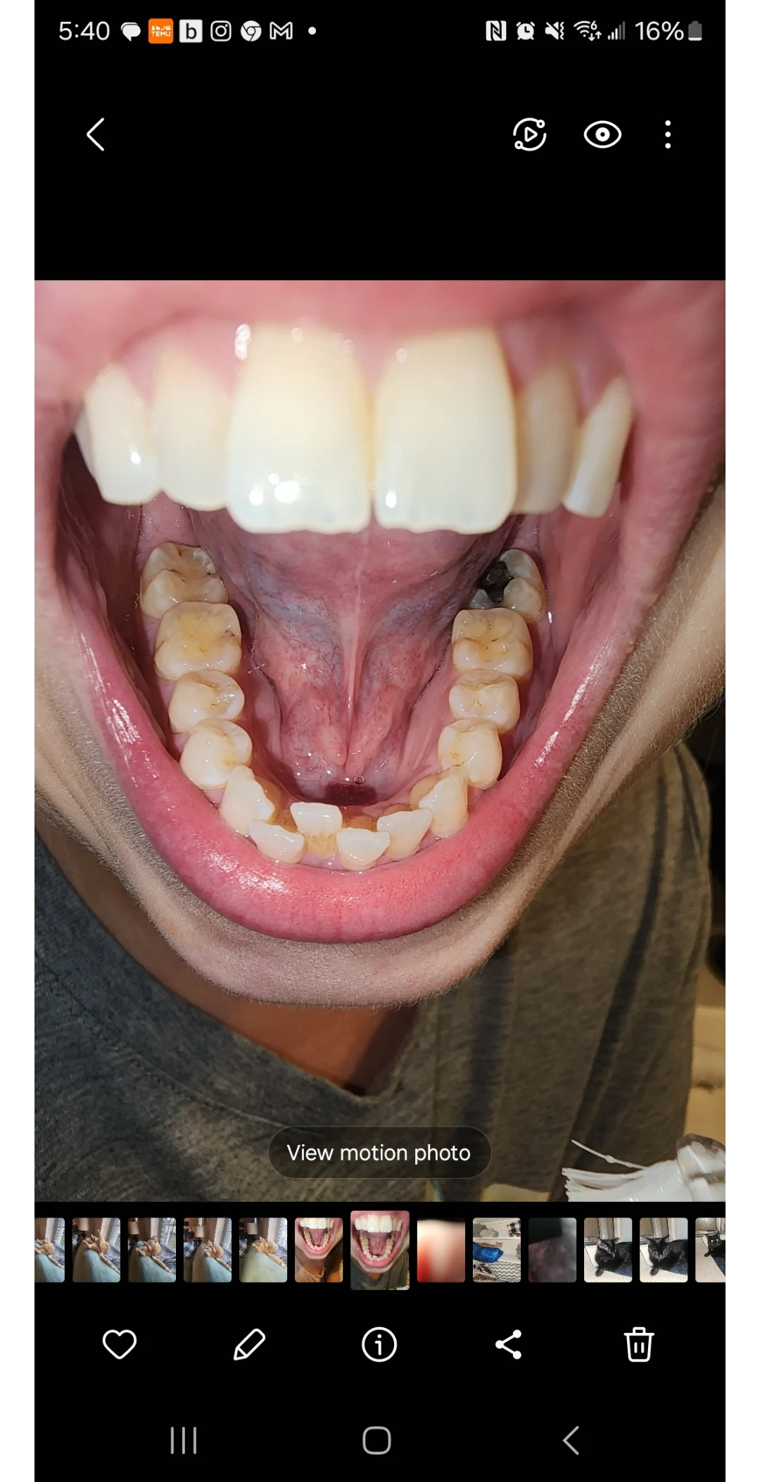 Is this normal | Scrolller