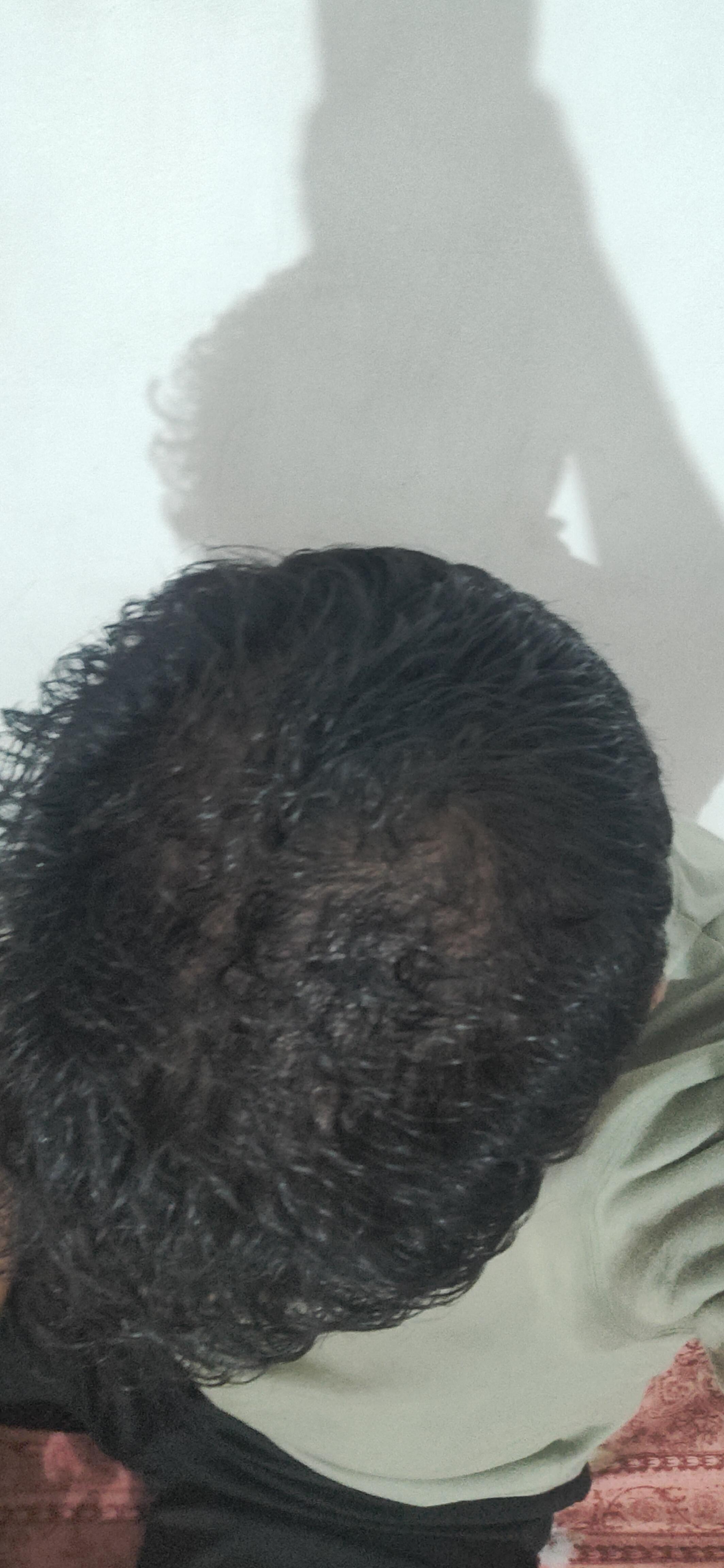 After and before applying oil | Scrolller