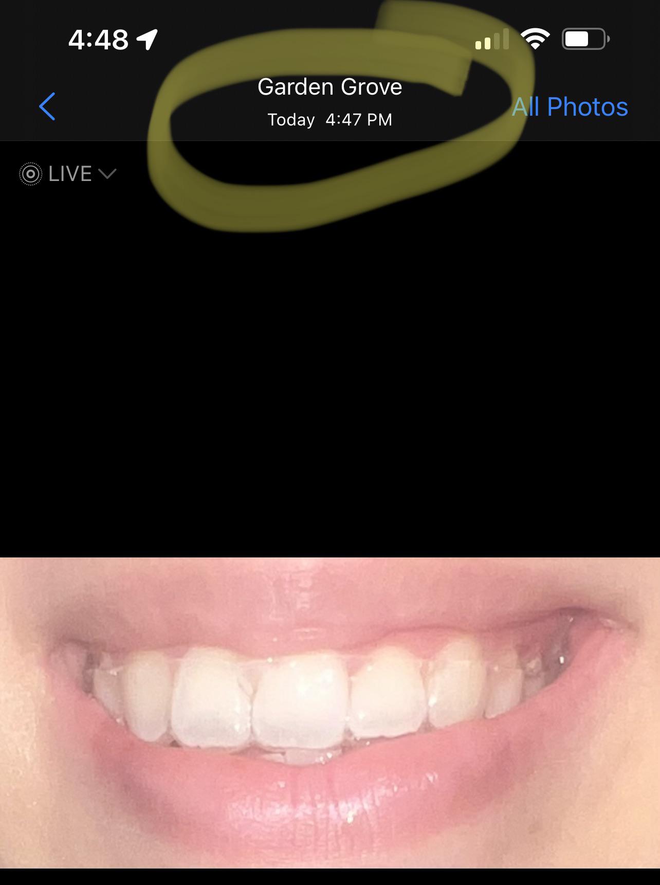 ADDITIONAL PROOF | Scrolller