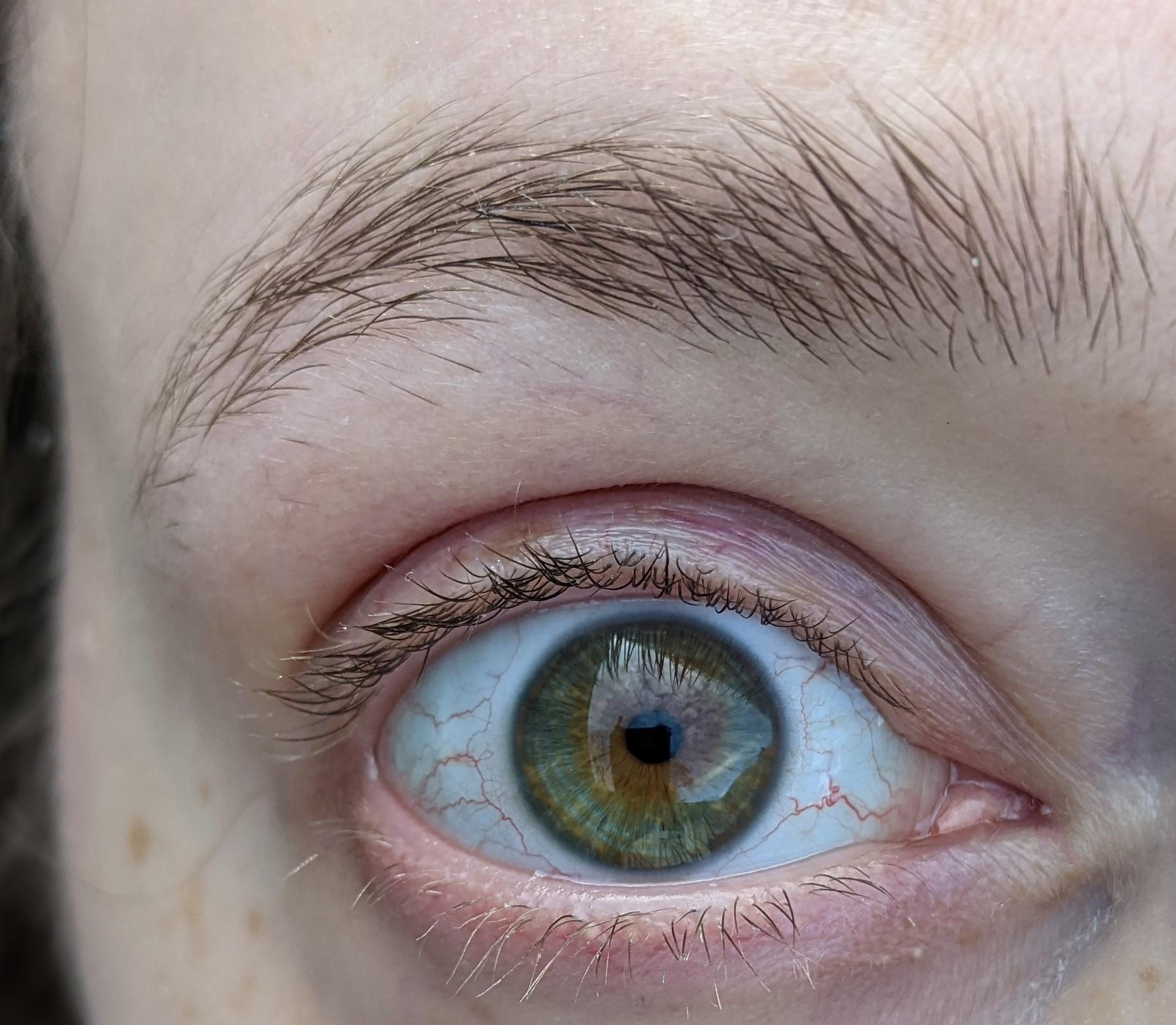 Eye confusion | Scrolller