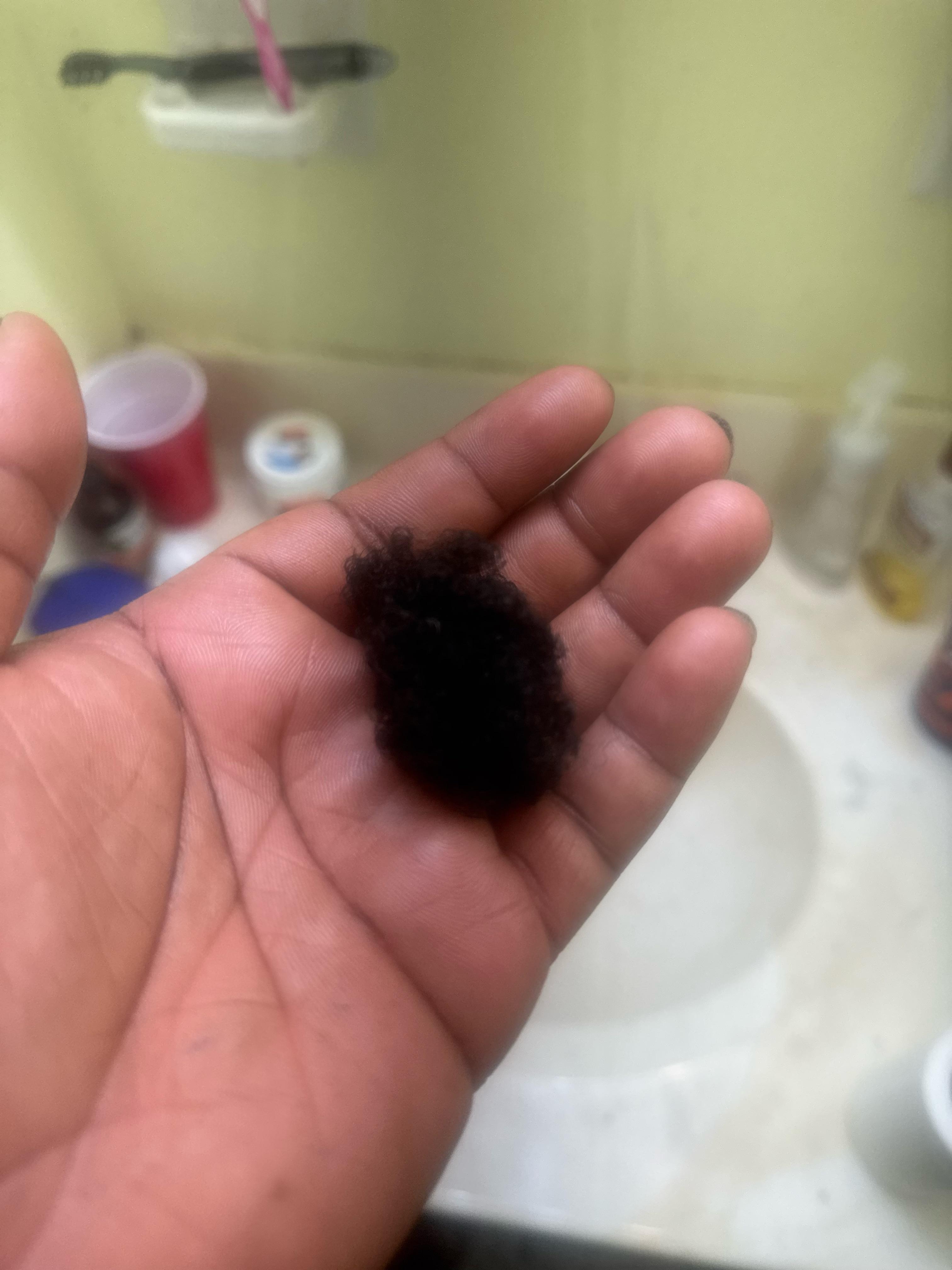 Is this just Shedding | Scrolller