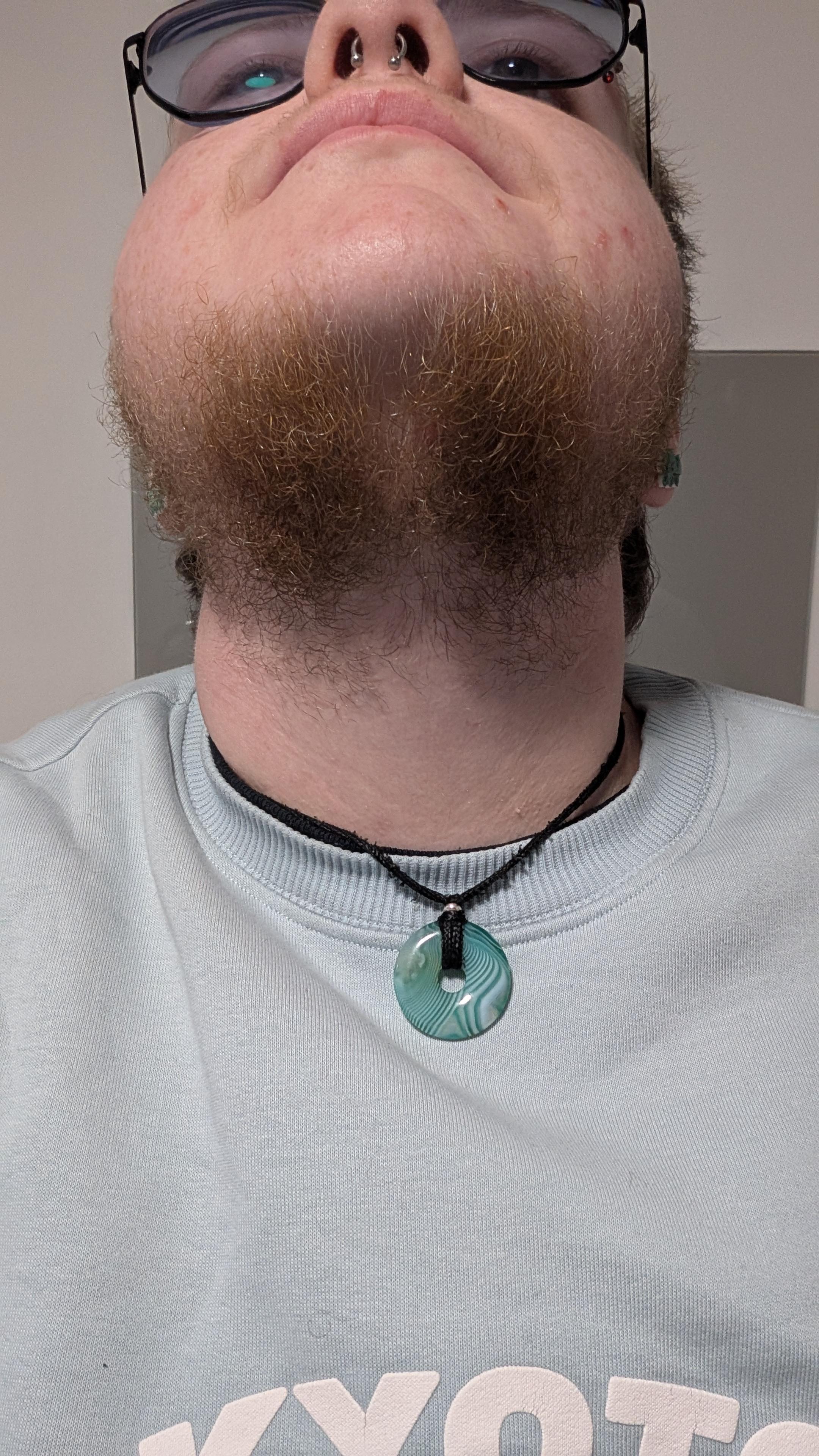 FTM Beards...All the Advice | Scrolller