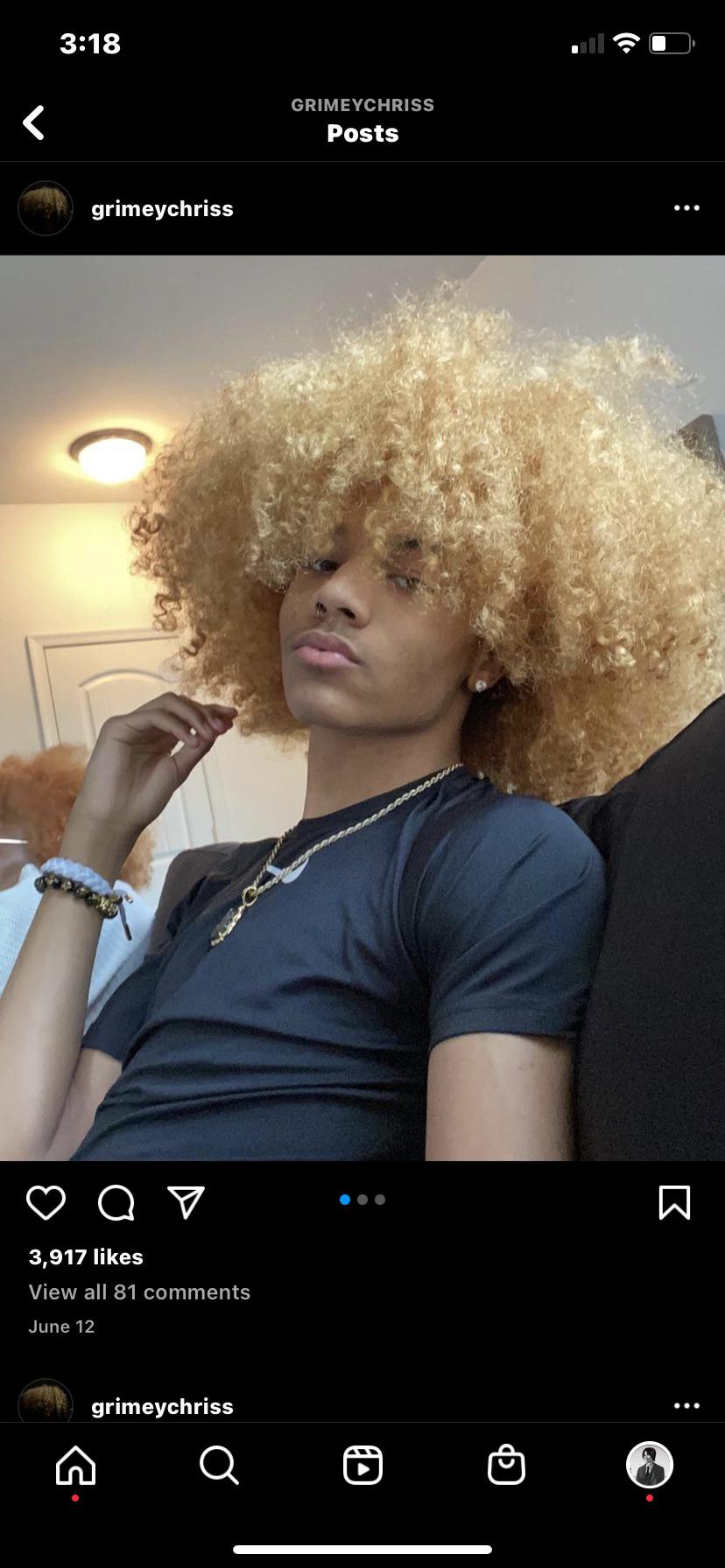 How does he manage to have this much hair, and Is it possible to replicate? | Scrolller