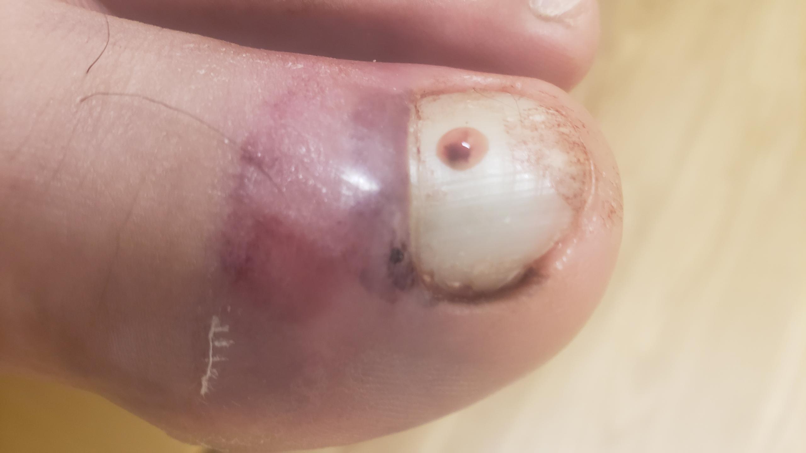 Metal ramp | Scrolller