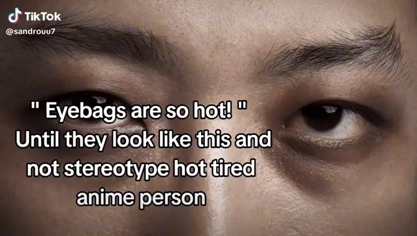 Mine is worse than all of these combined too | Scrolller