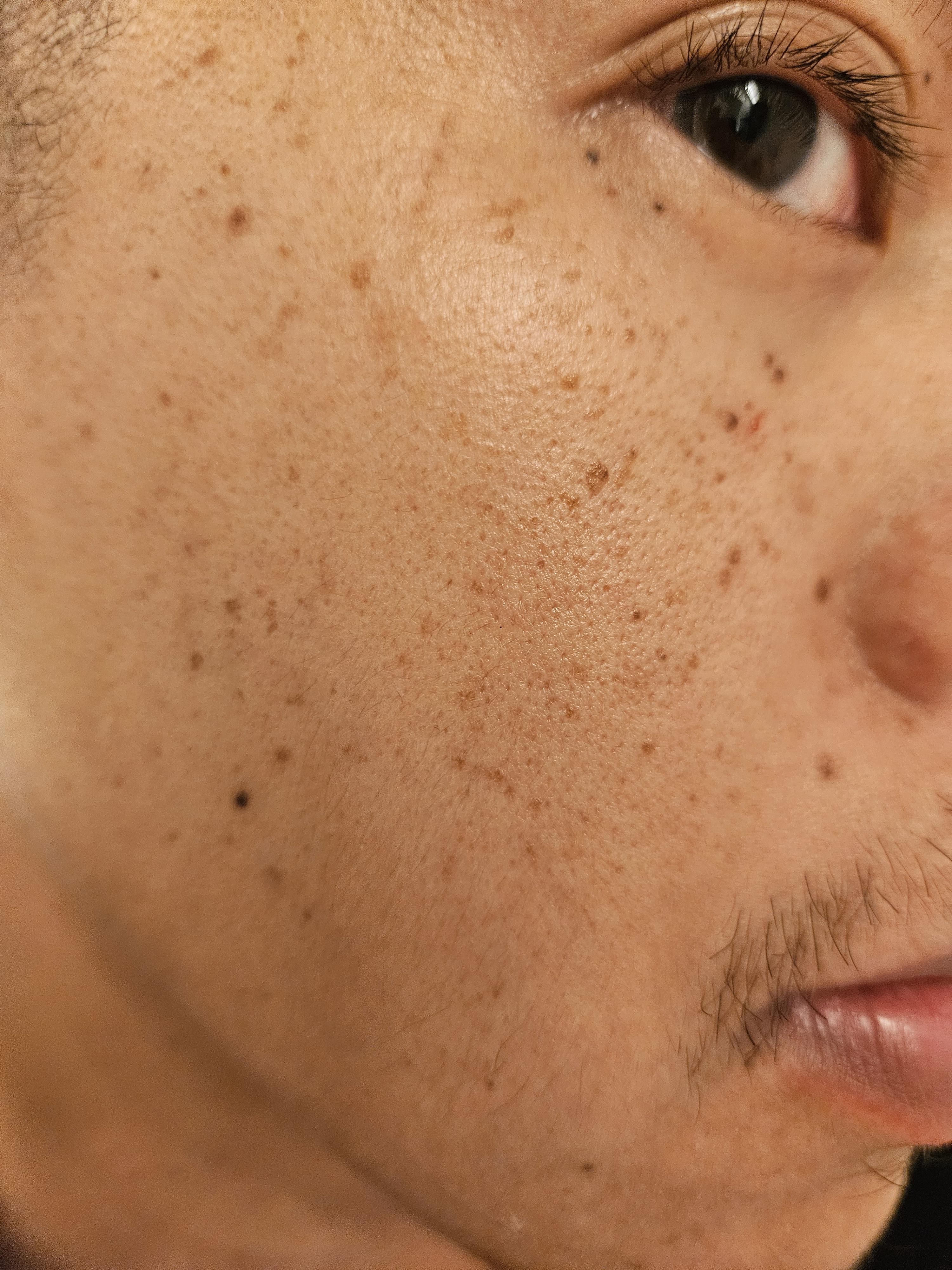 How can I get rid of these bumps and dark spots I've gotten as I aged? Willing to pay for any ...