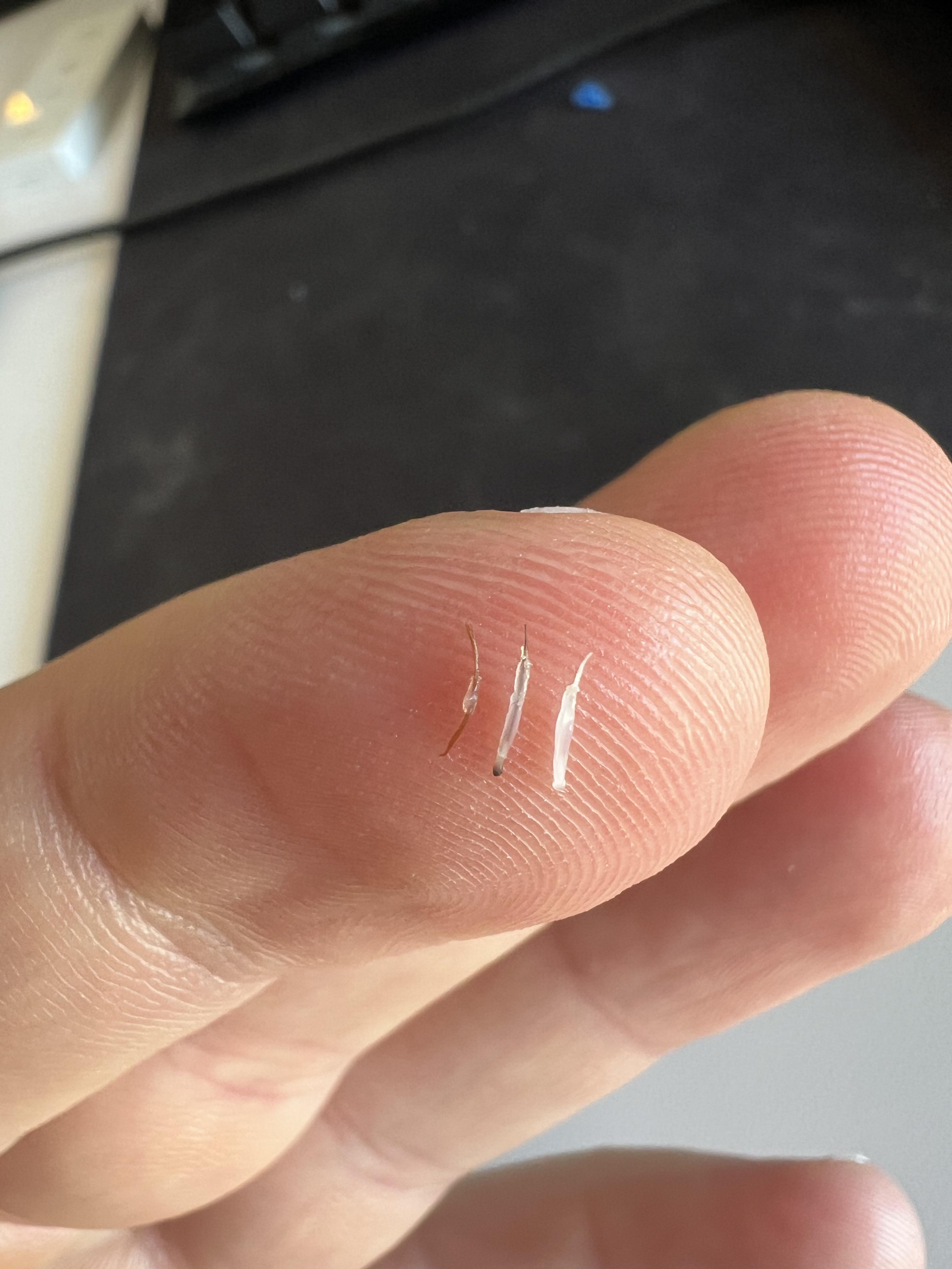 Normal hair vs painful hairs | Scrolller