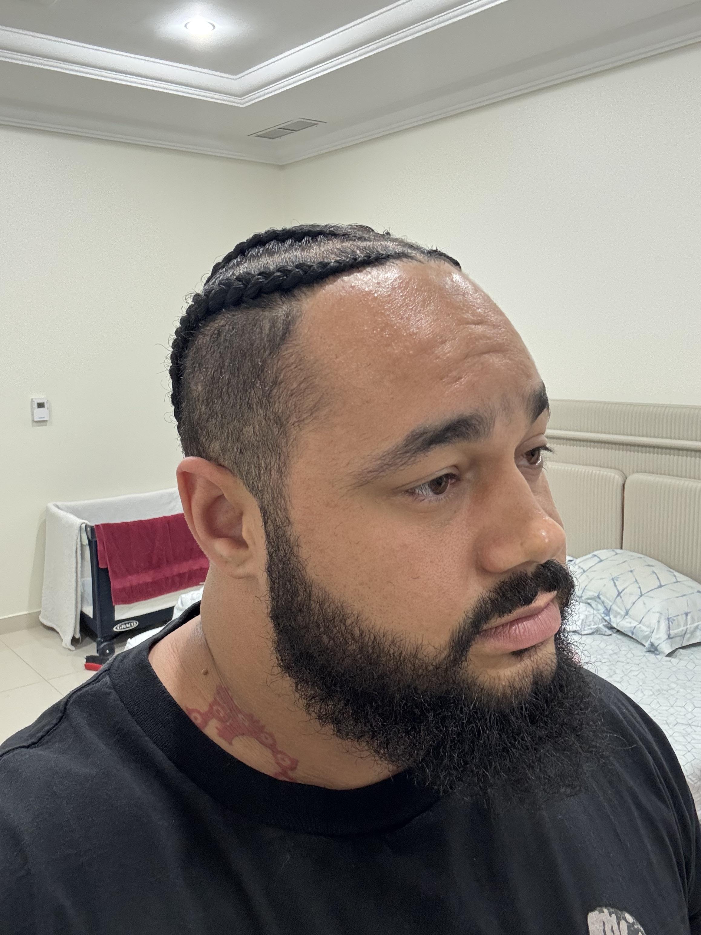 1st time cornrows | Scrolller