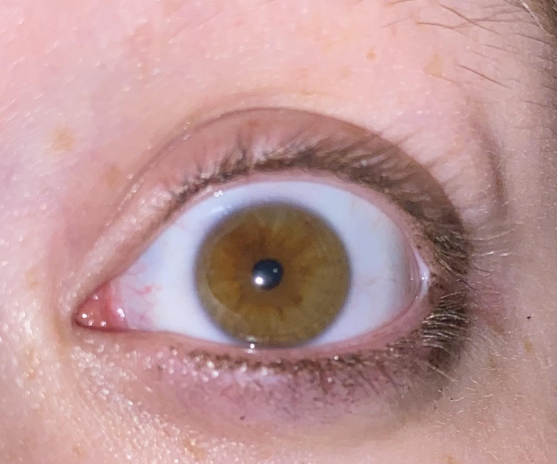 Partial heterochromia? | Scrolller