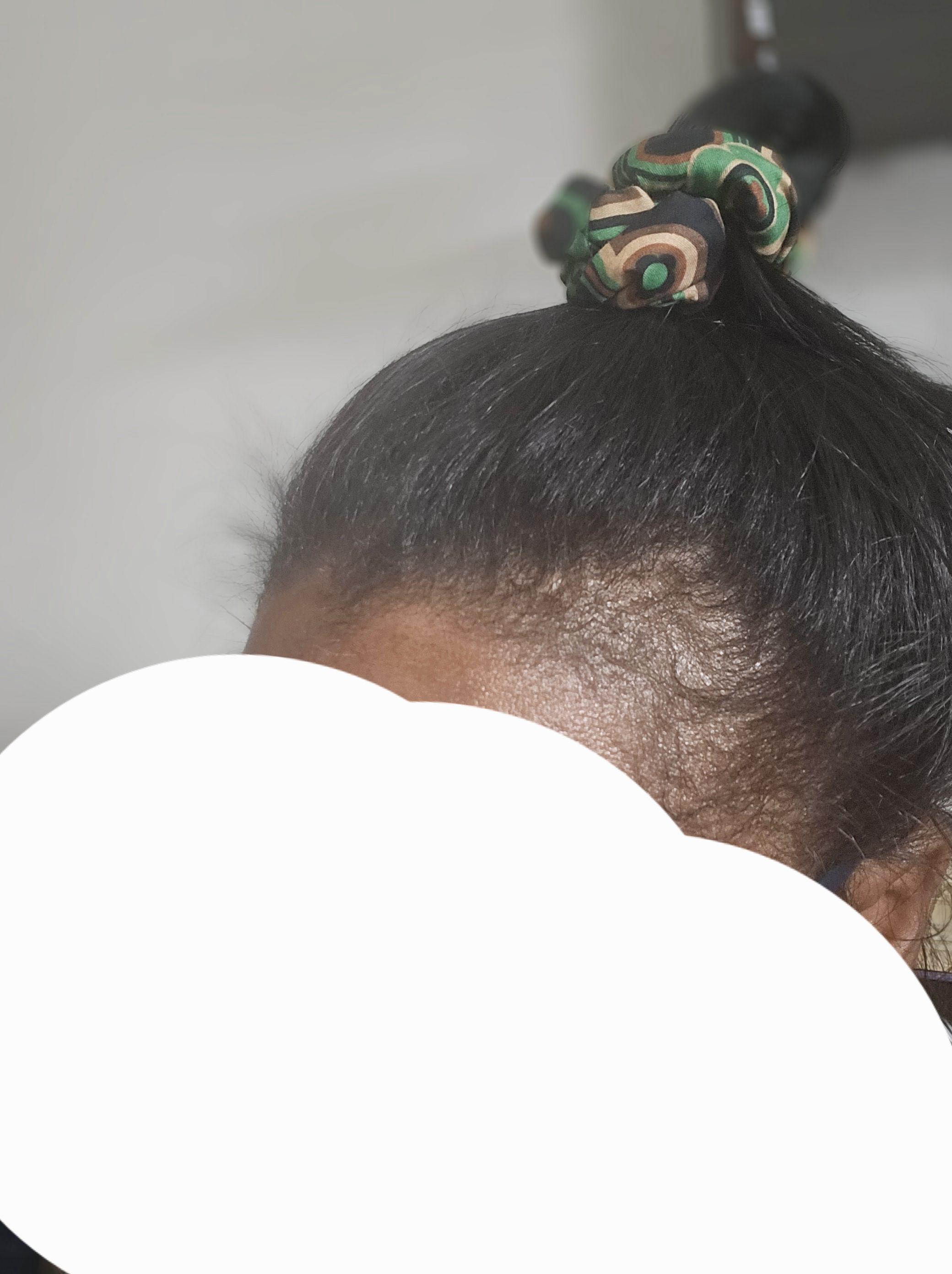 Is my hair actually thinning or am I freaking out? | Scrolller