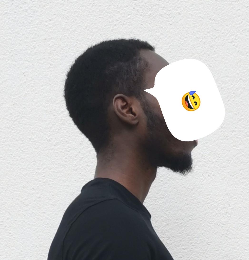 Please Help with Hair Texture Change, Dry & Itchy Scalp – Seeking Advice | Scrolller