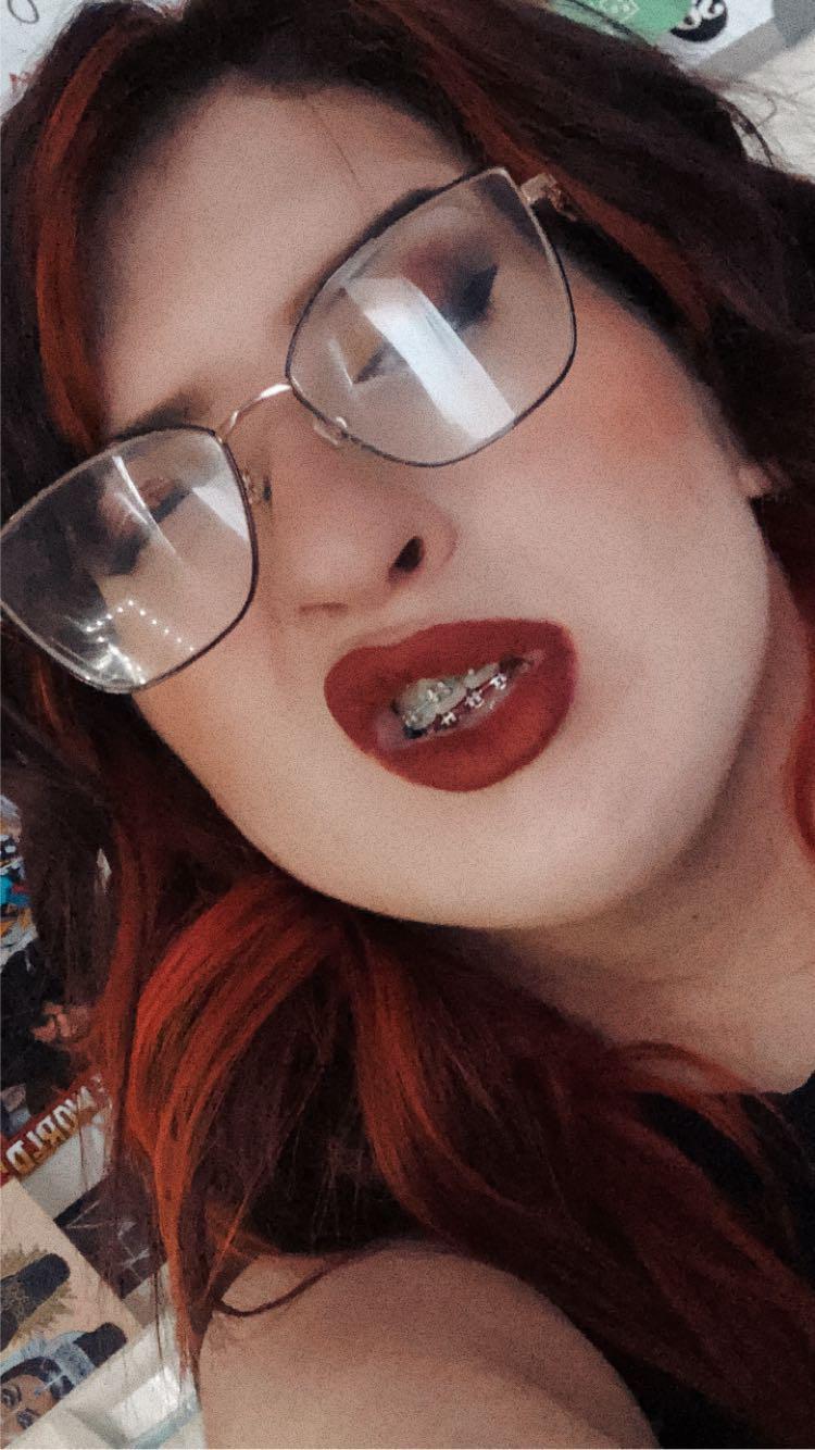 Scheduled my removal appointment for my birthday! How ceremonious! | Scrolller