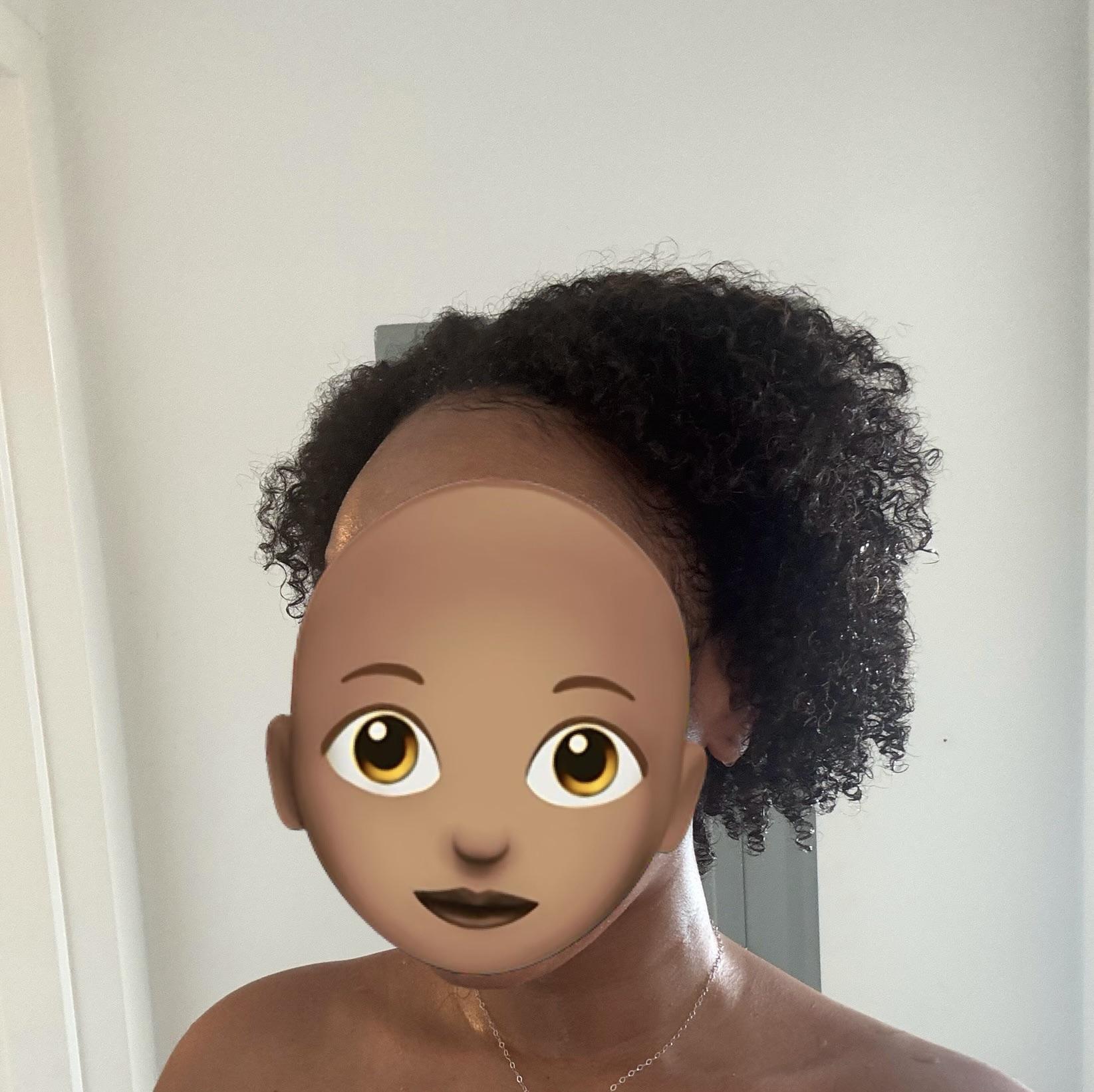 Does this look like a lot of shedding? | Scrolller