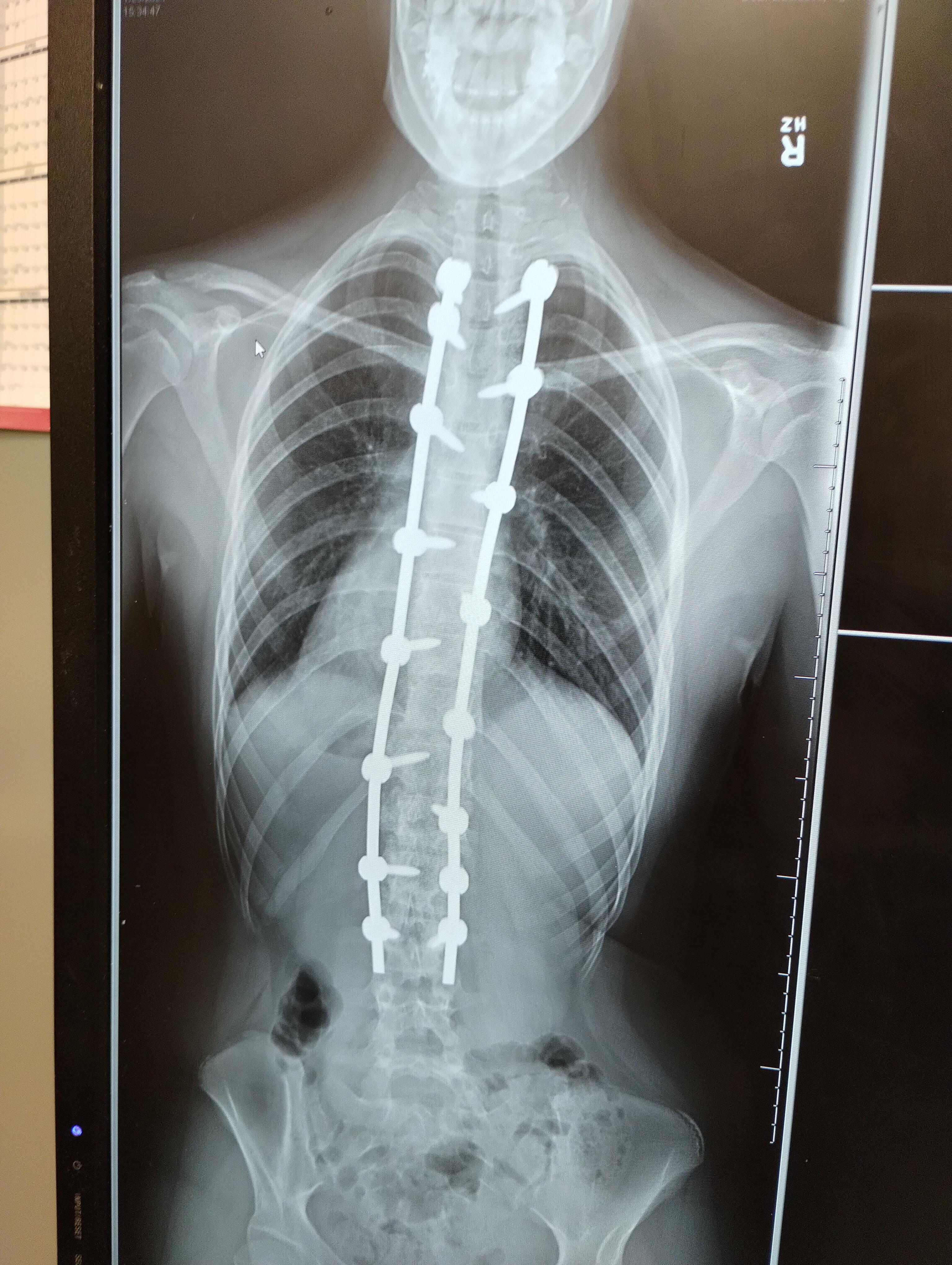 We're showing X-rays? Here's my daughter. | Scrolller