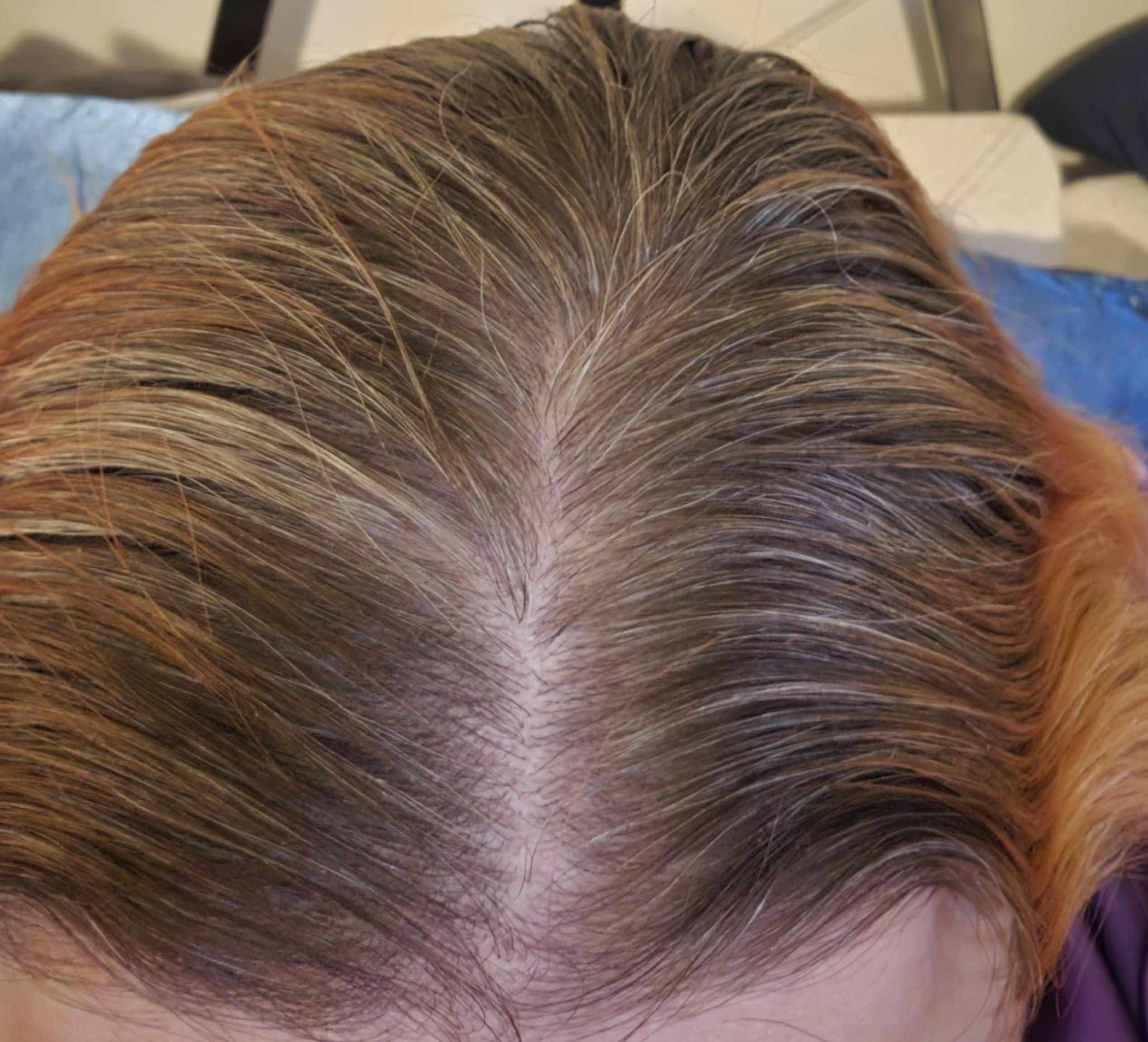 Root level help | Scrolller