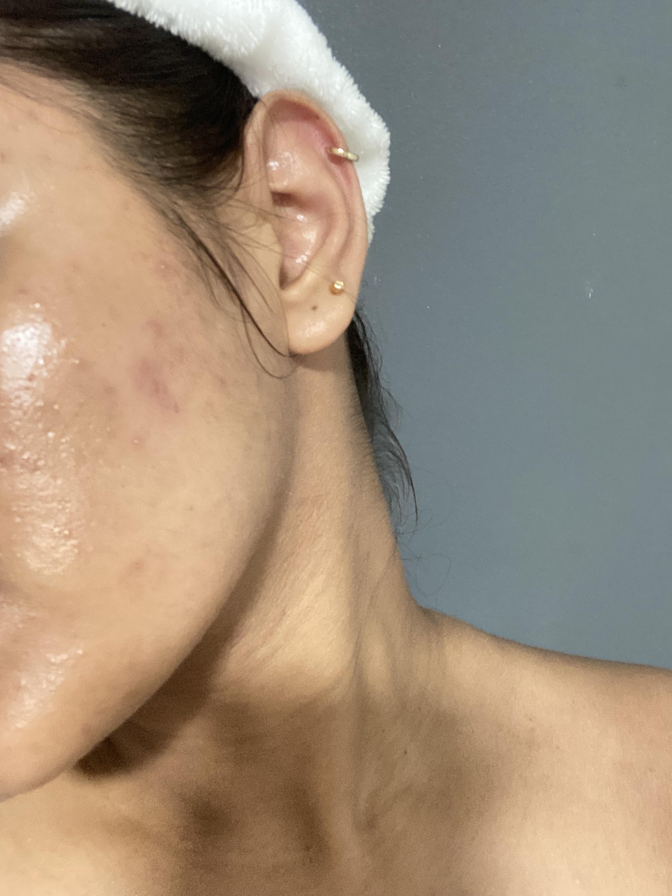 What are these small bumps | Scrolller