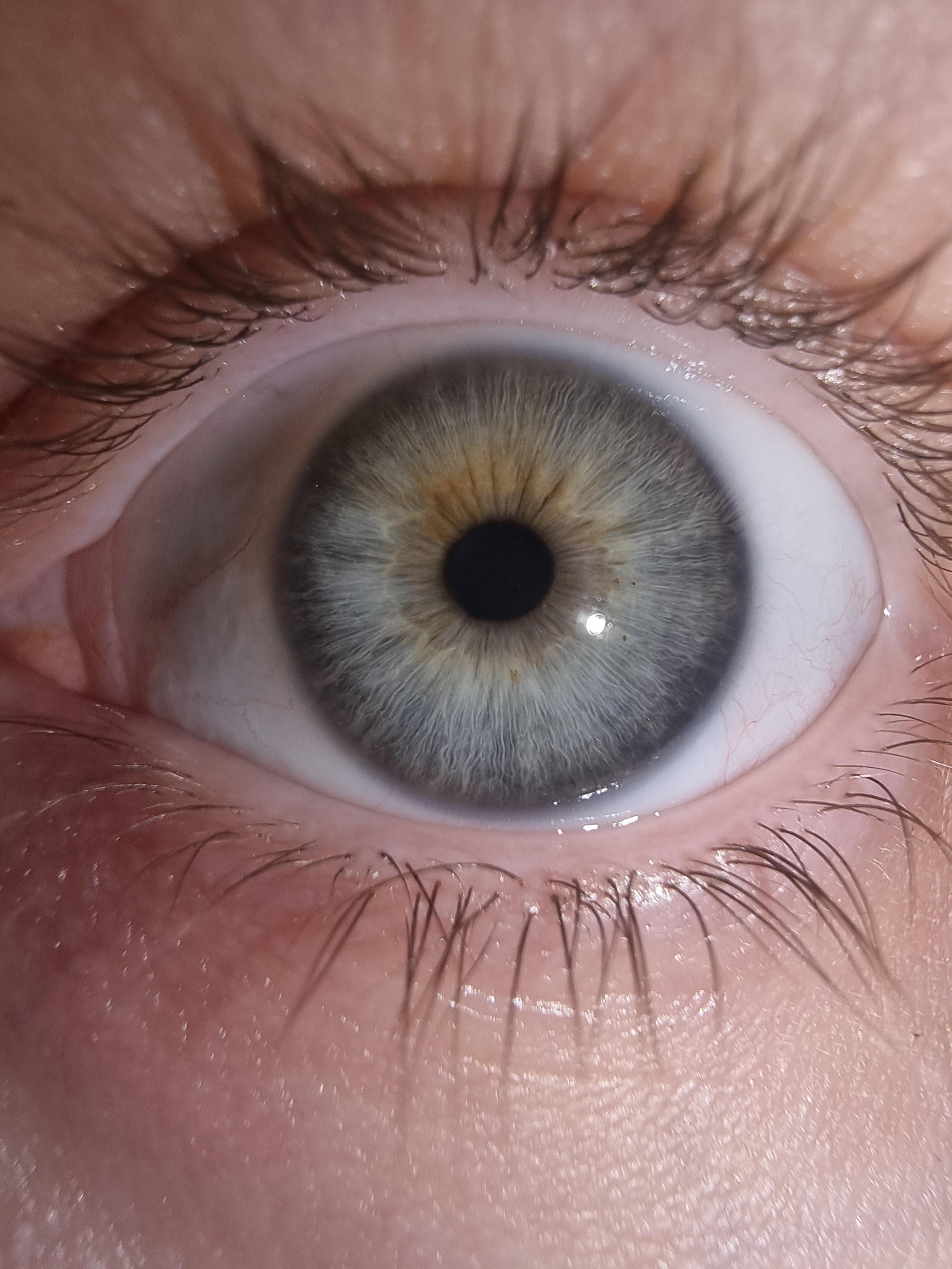 Blue Hazel? | Scrolller