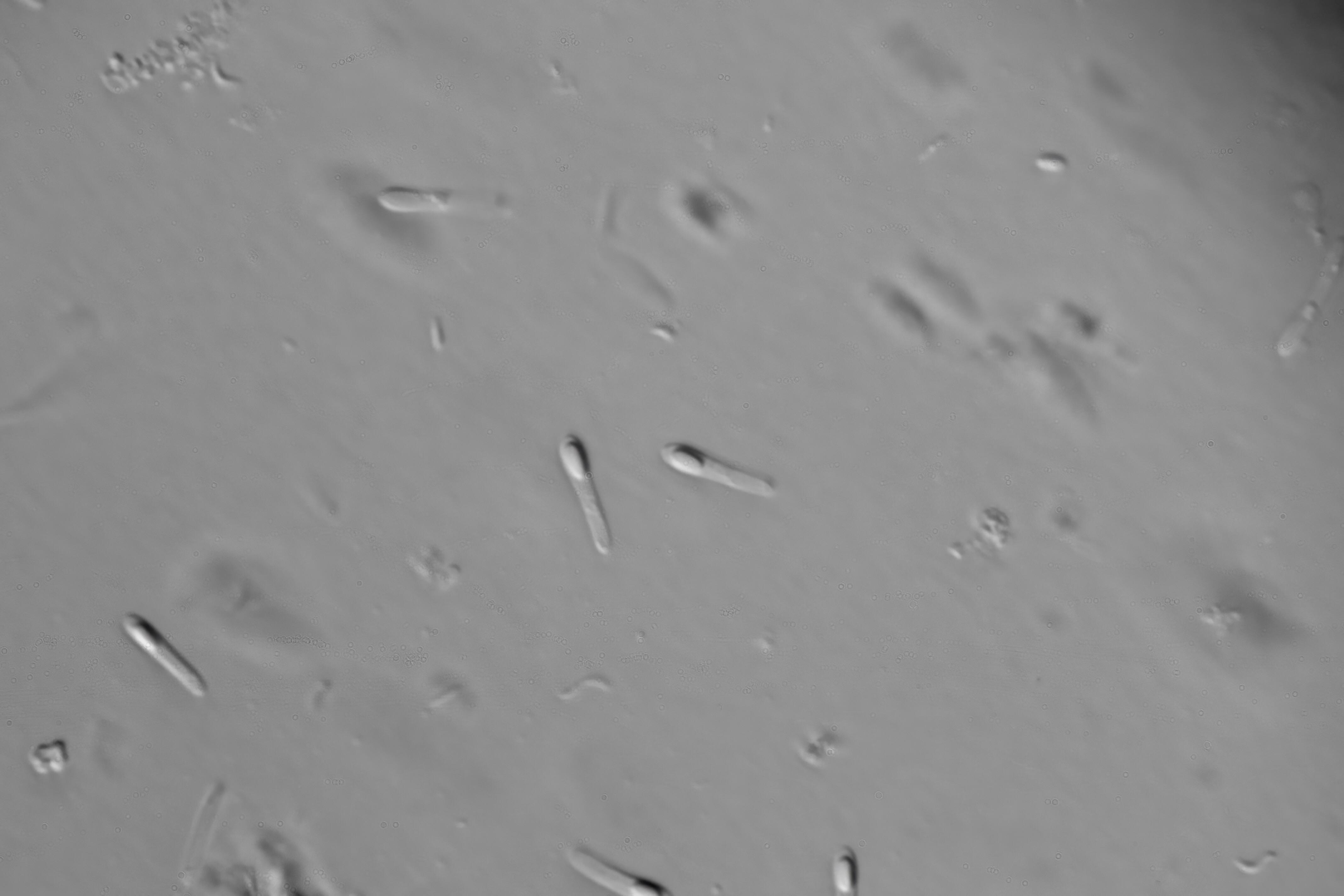 Some more bacteria | Scrolller