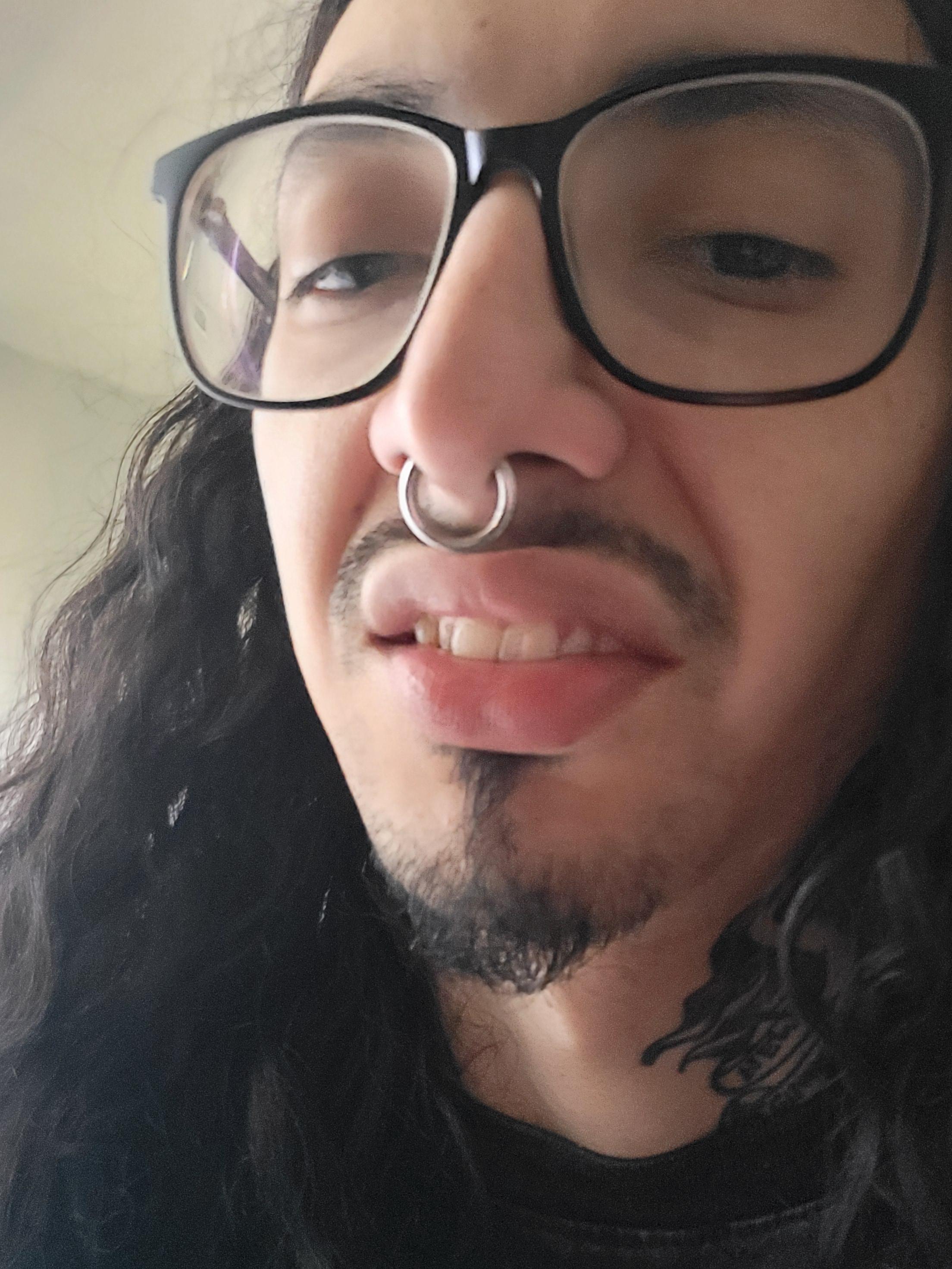 10 g is it too low? Bad placement? | Scrolller