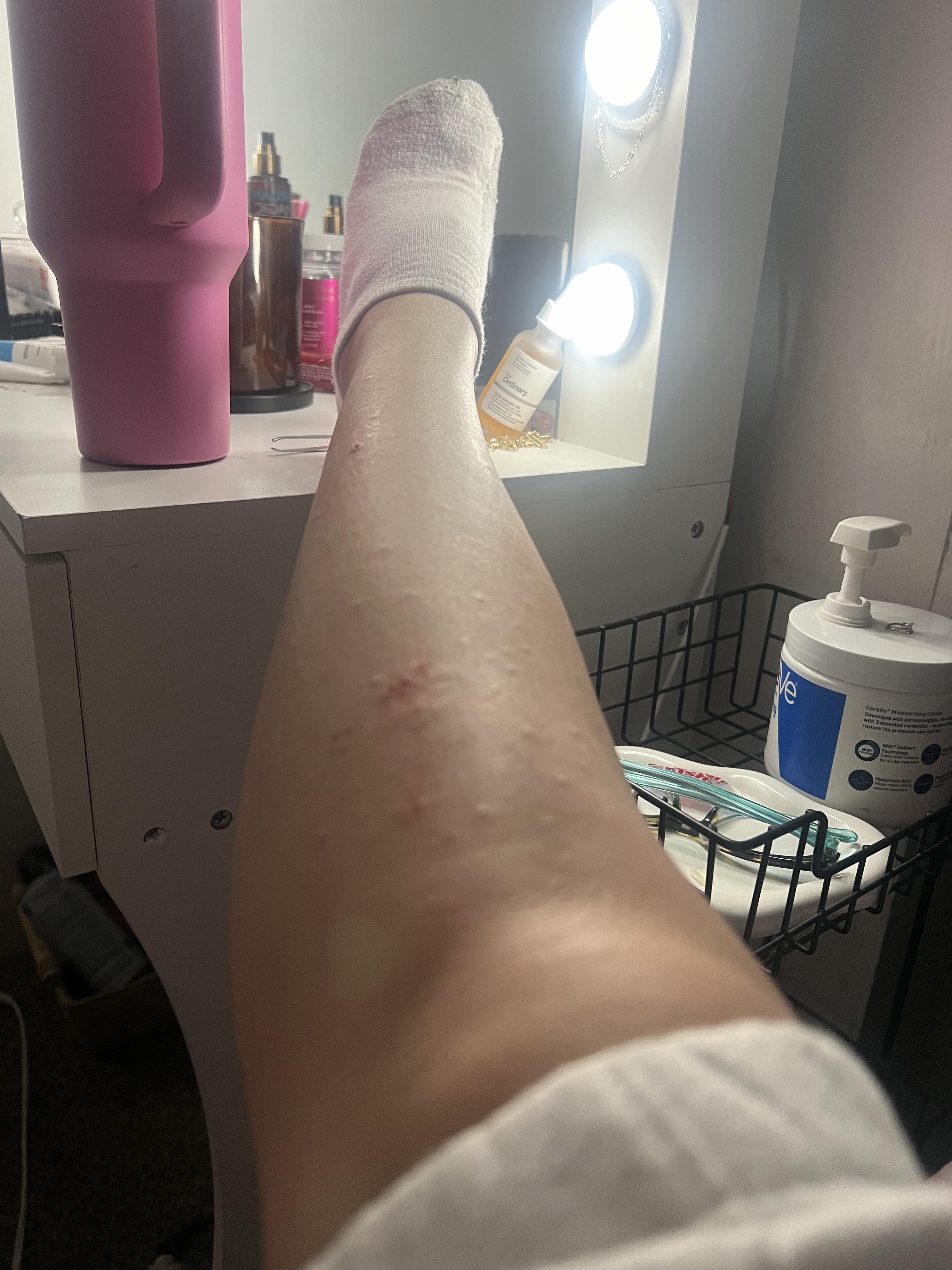 Skin issue | Scrolller