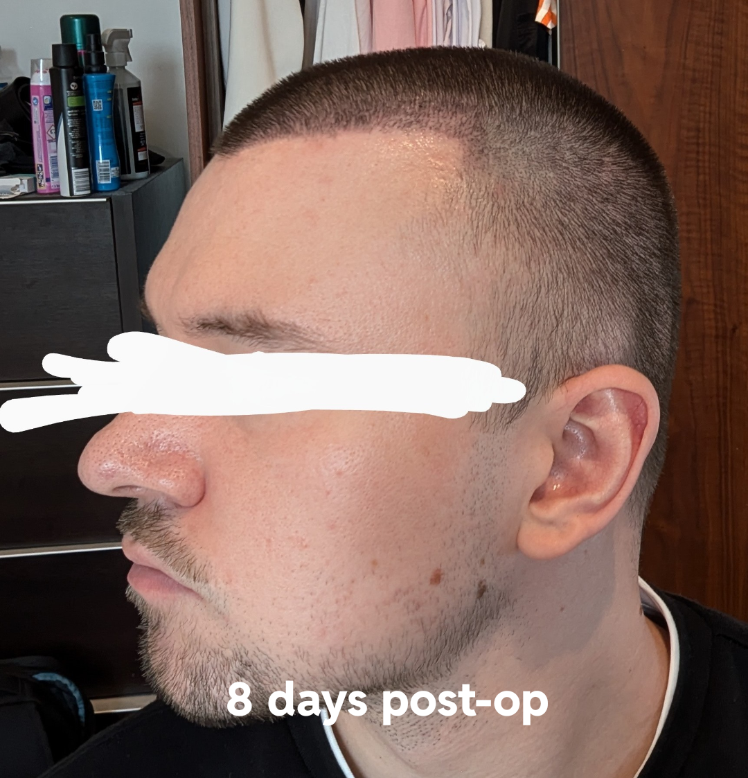 Opinions on Density? | Scrolller