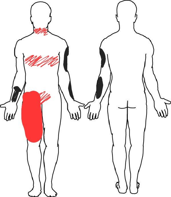 Placement ideas | Scrolller