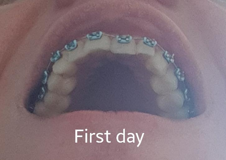 4 month progress! | Scrolller