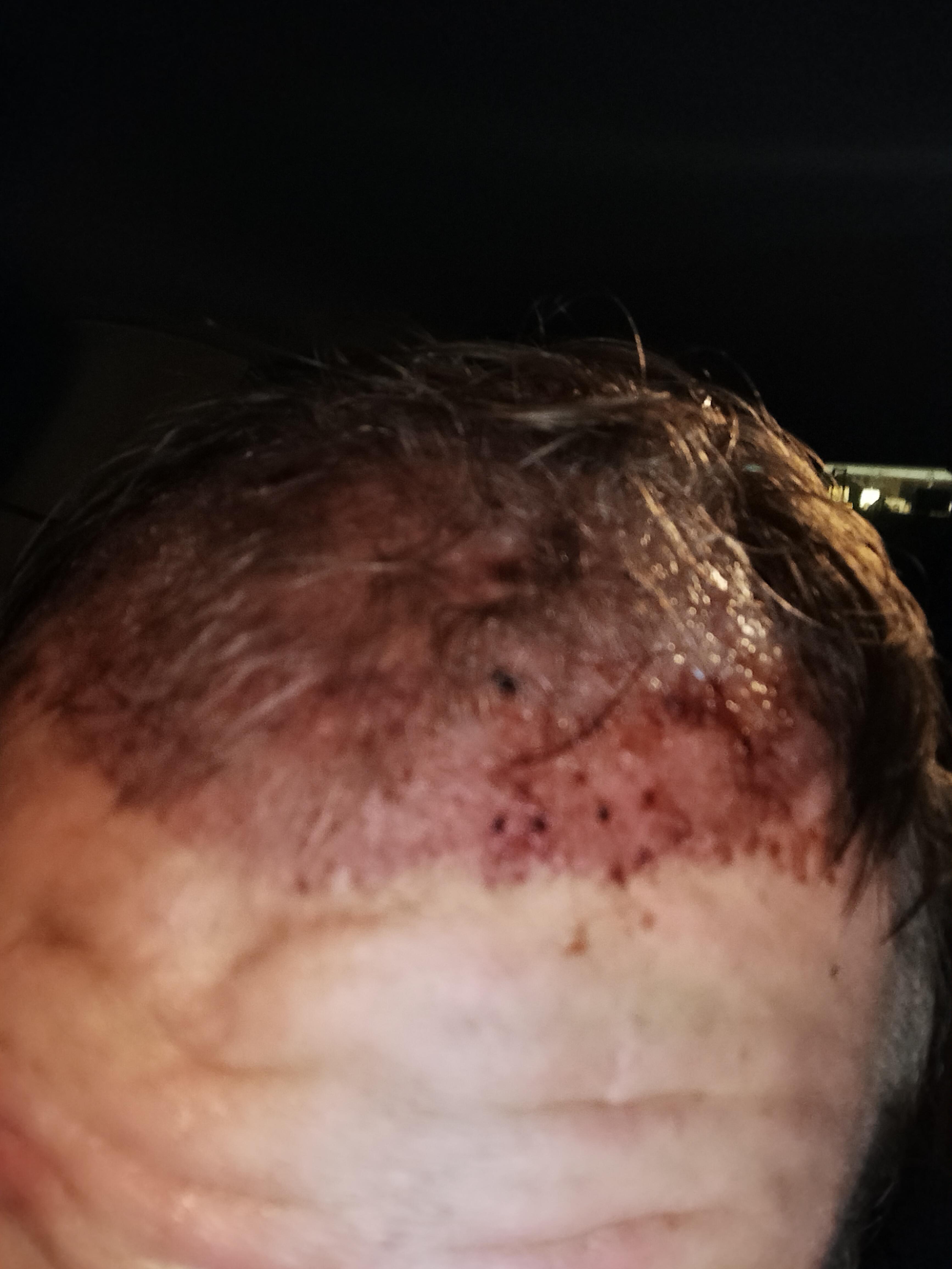 Buzzed at four months | Scrolller