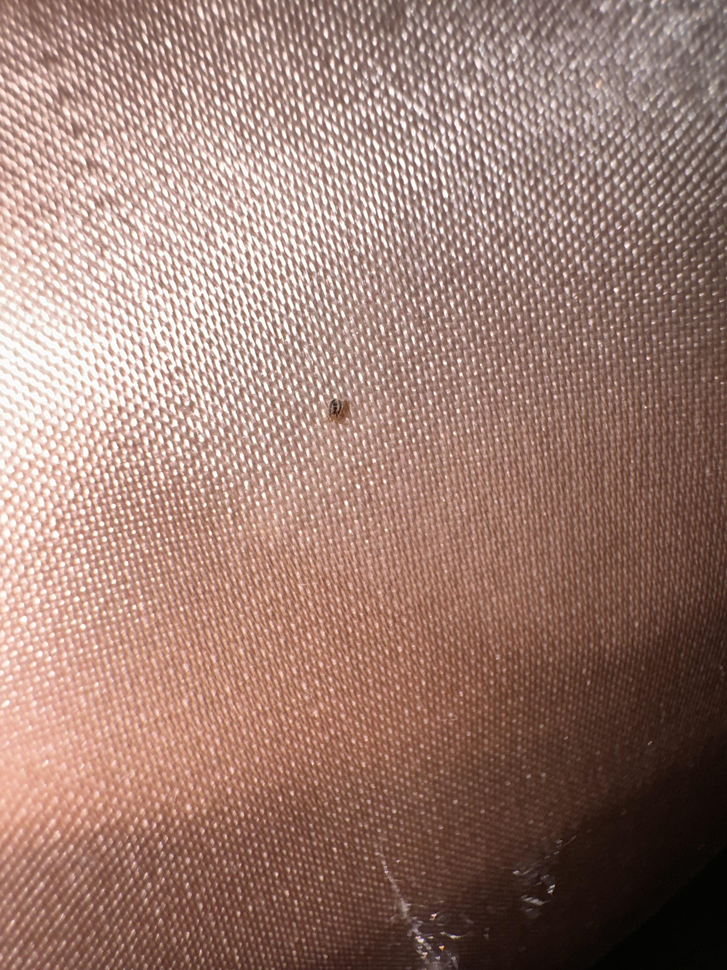 Are these bed bugs? | Scrolller