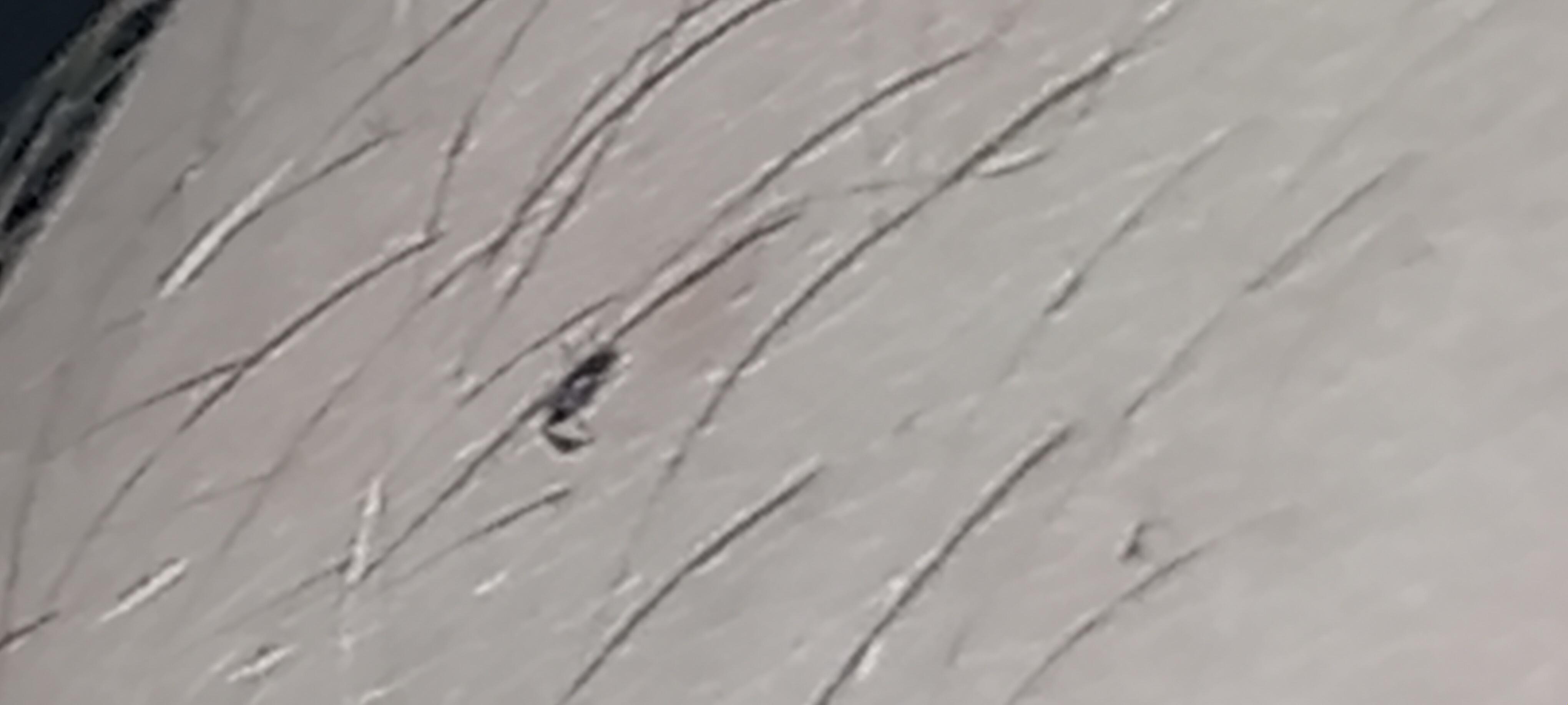 Discover more like Bedbugs: Whats this meant to be? and Related Content | Scrolller