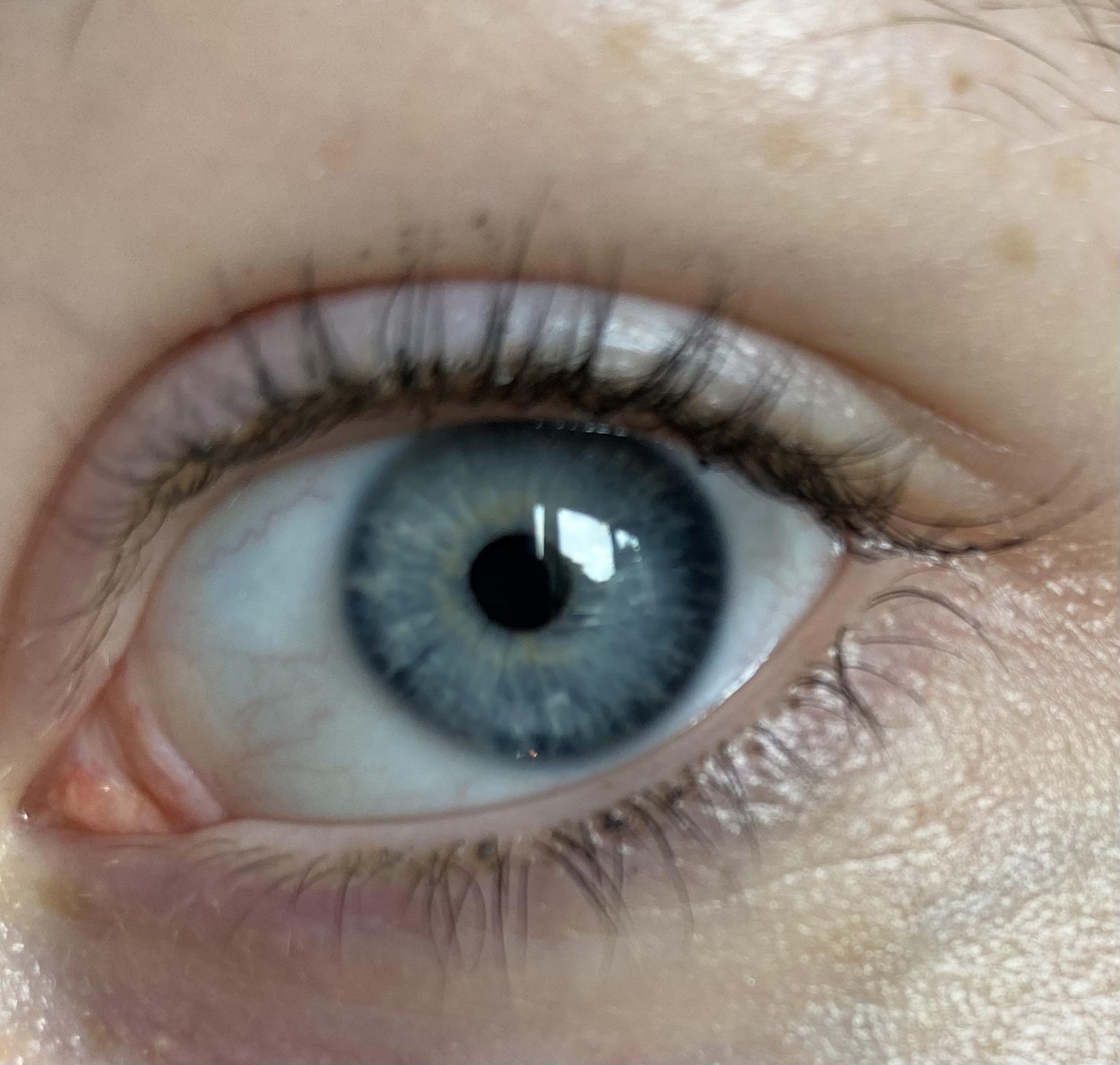 Discover more like Eyes: Are these orbs definitely grey? and Related Content | Scrolller